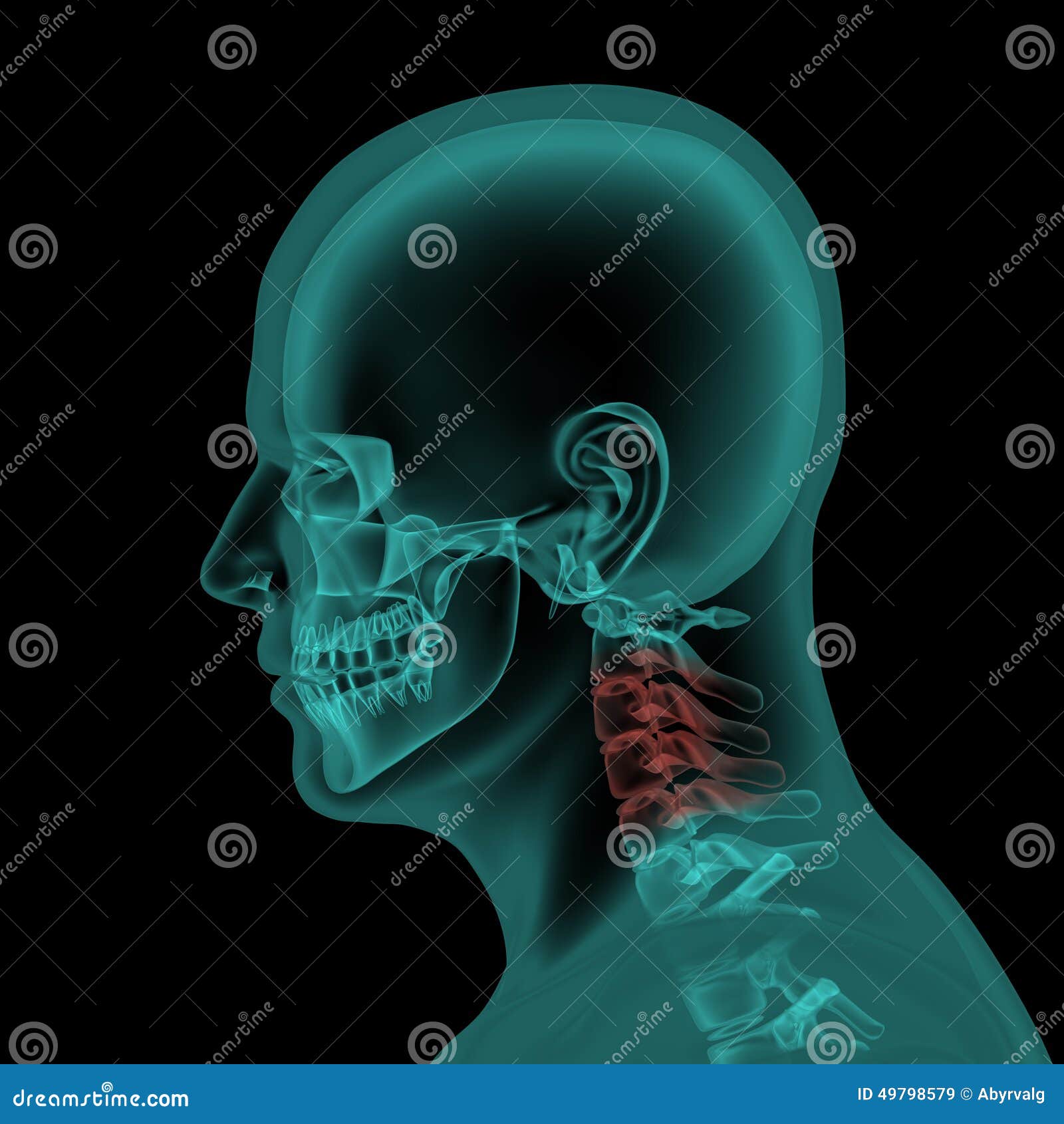 Lateral X-ray View of Human Skull and Neck Stock Illustration ...