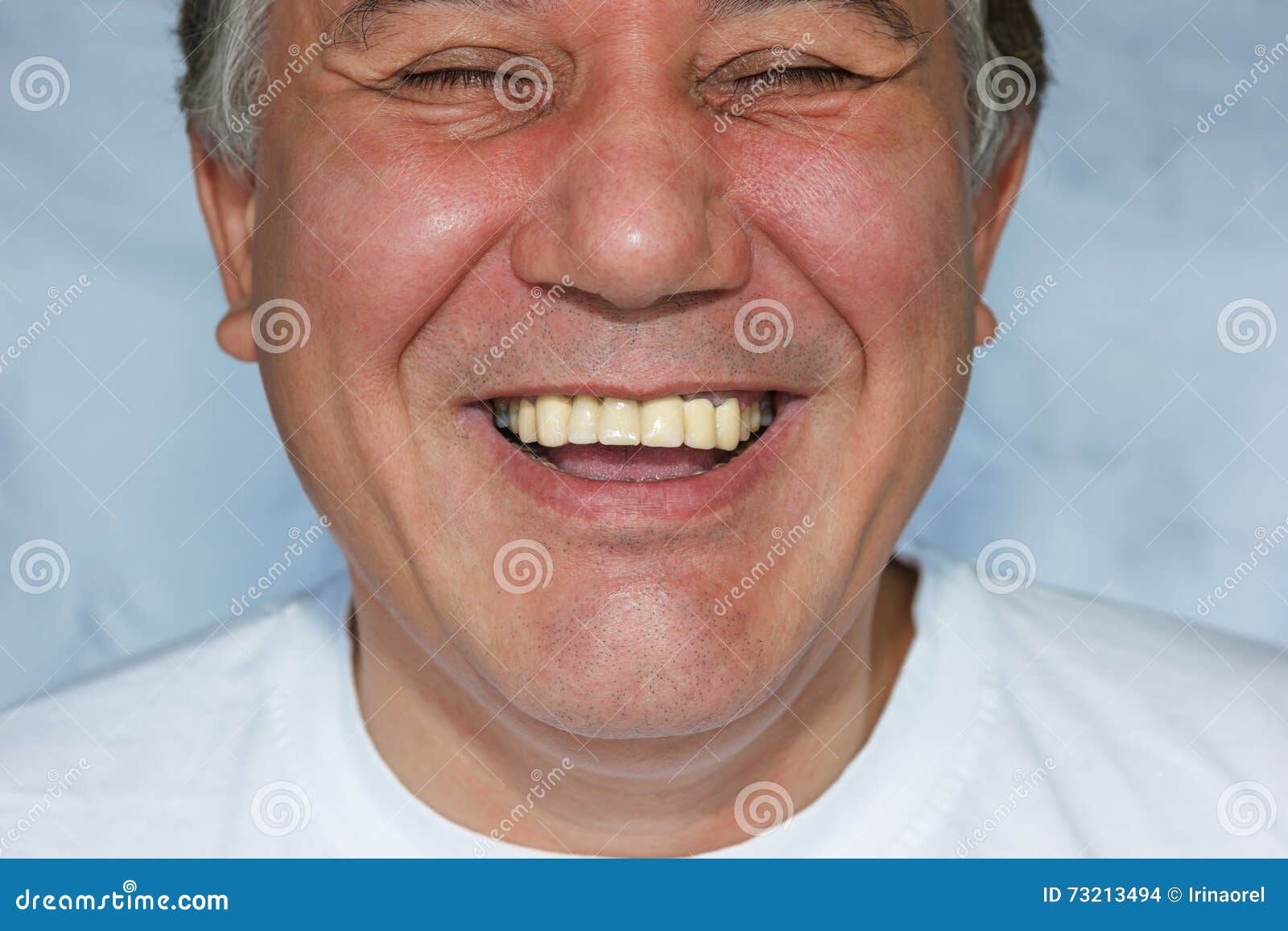 Laughing Man with False Teeth Stock Photo - Image of chin, completion ...