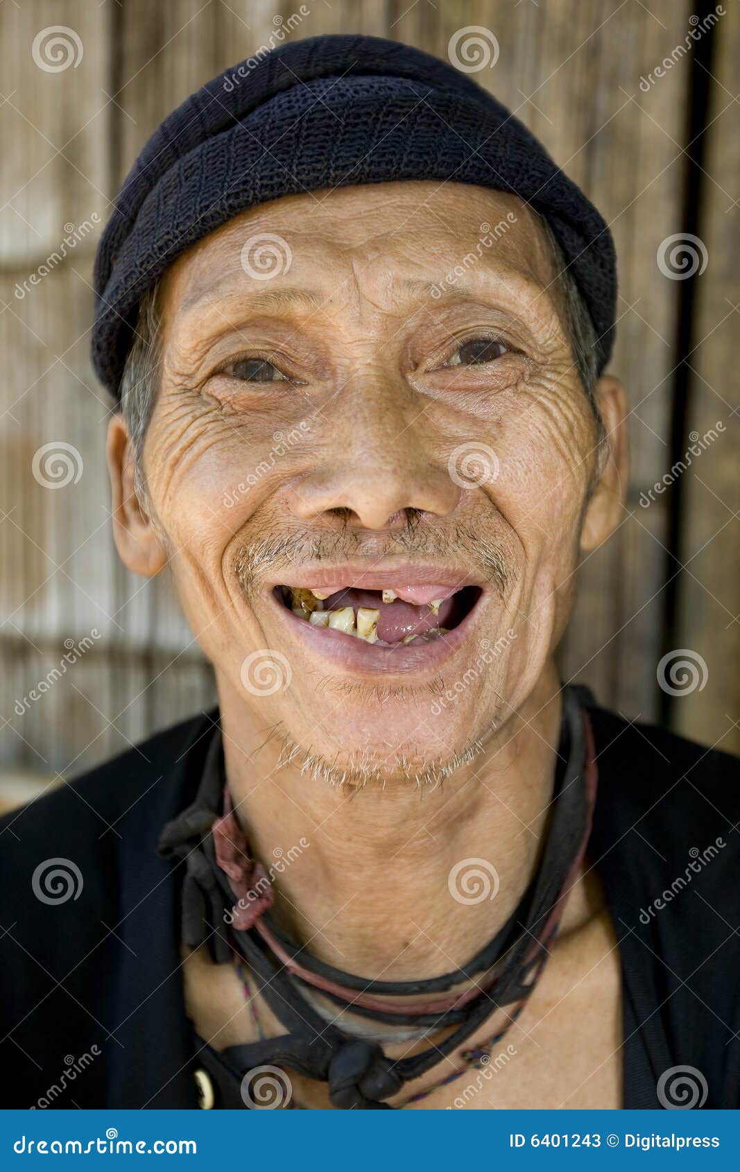 Laughing Old Man with Bad Teeth, Laos Stock Image - Image of portrait ...