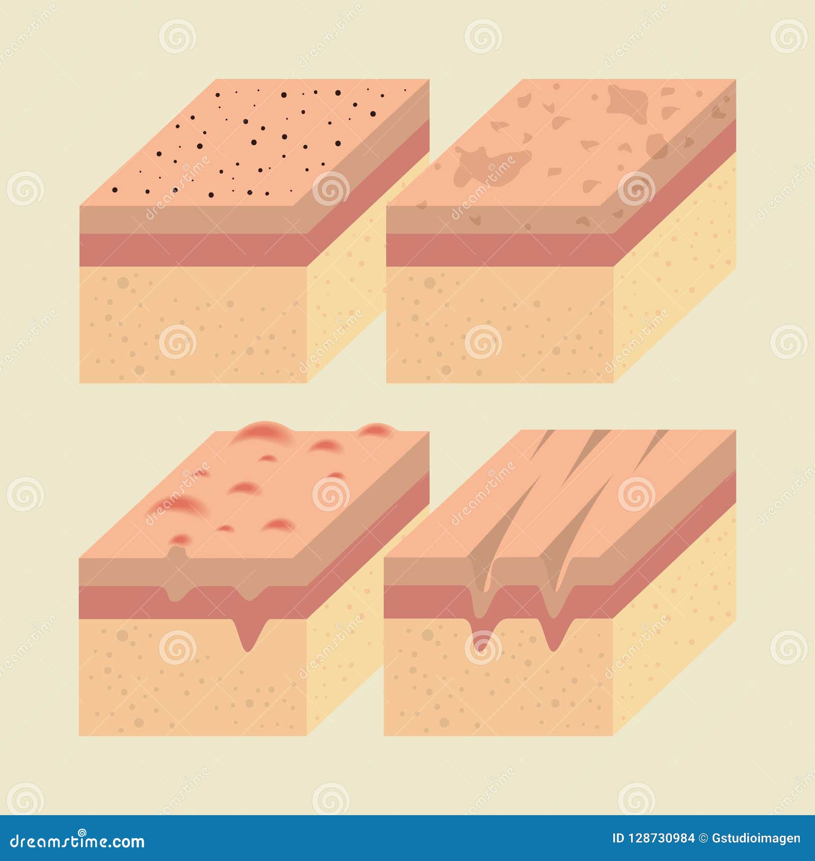 Layers of skin types stock vector. Illustration of human - 128730984