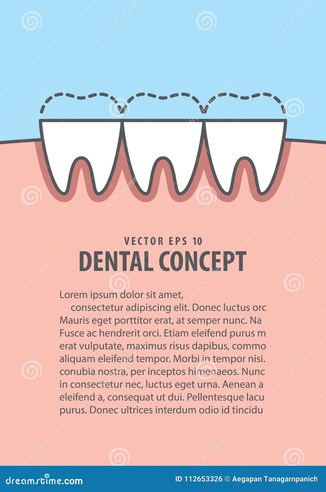 Attrition Treatment Comparison Illustration Vector On Blue Background ...