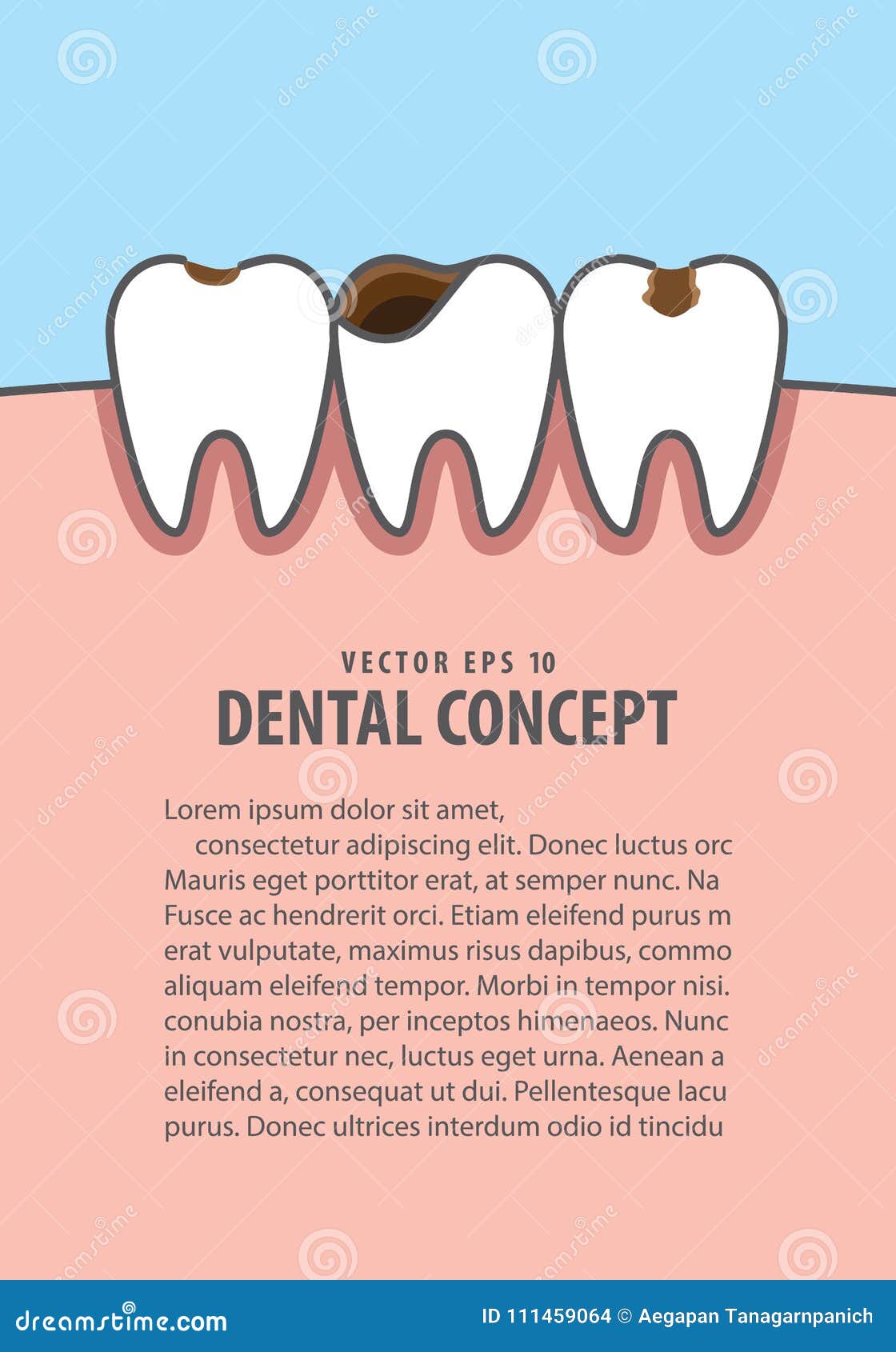 Layout Caries and Cavity Teeth Illustration Vector on Blue Background ...