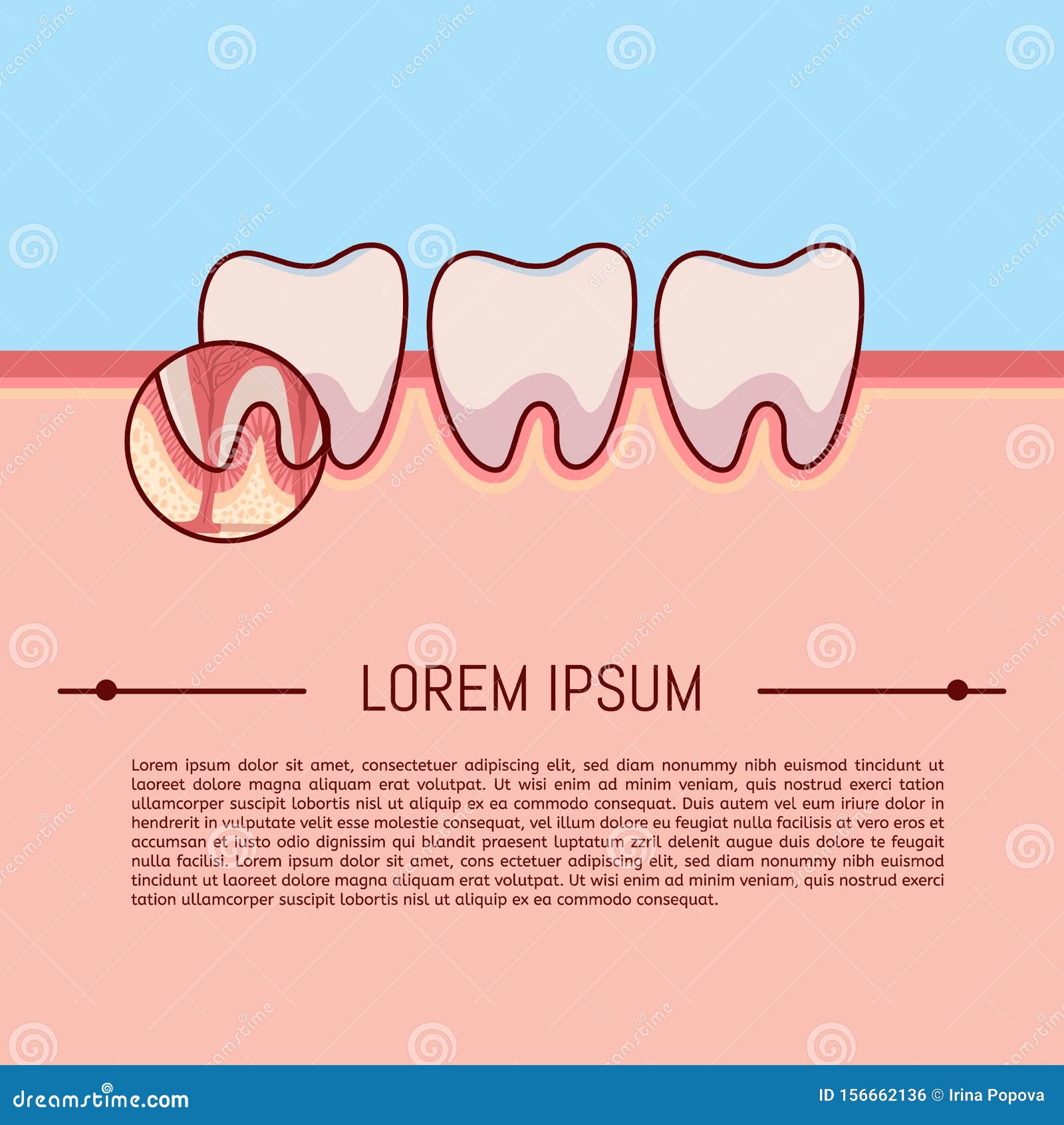 Layout Cross-section Structure Inside Tooth Illustration Vector On Blue ...