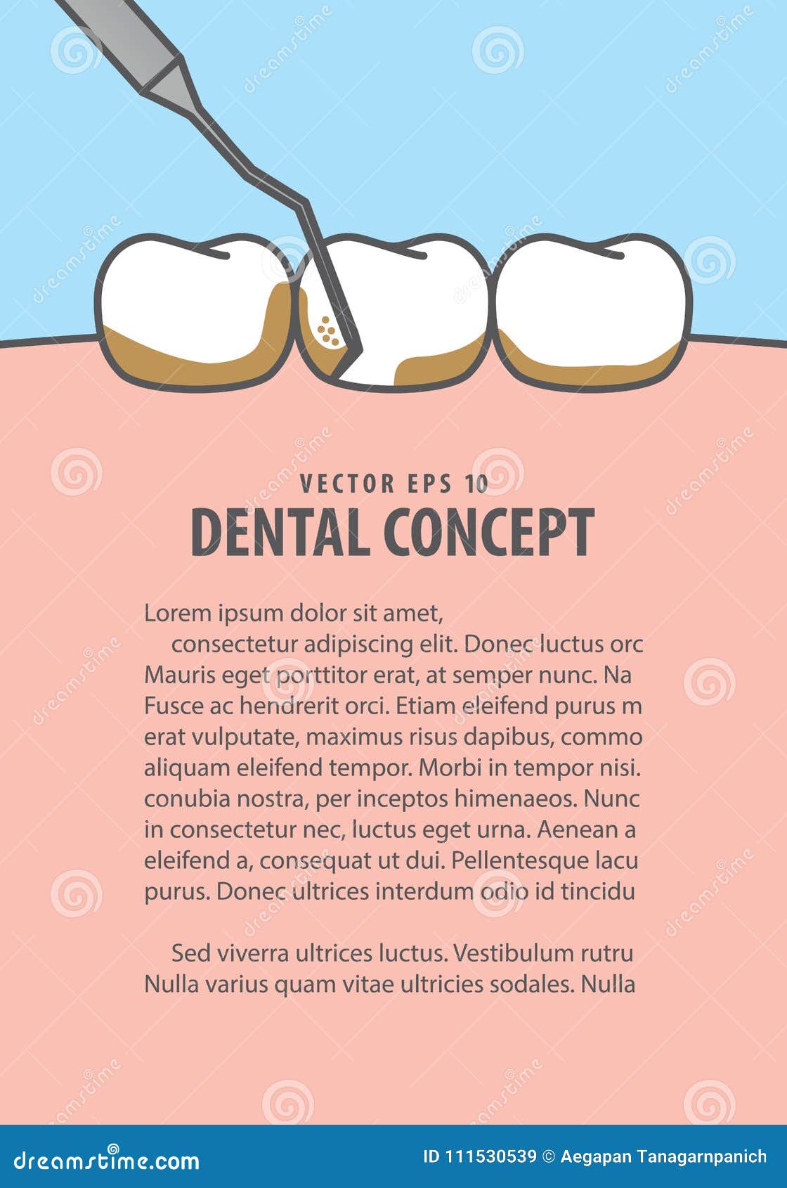 Teeth Scaling, Dental Plaque Removal For Cleaning Cartoon Vector ...