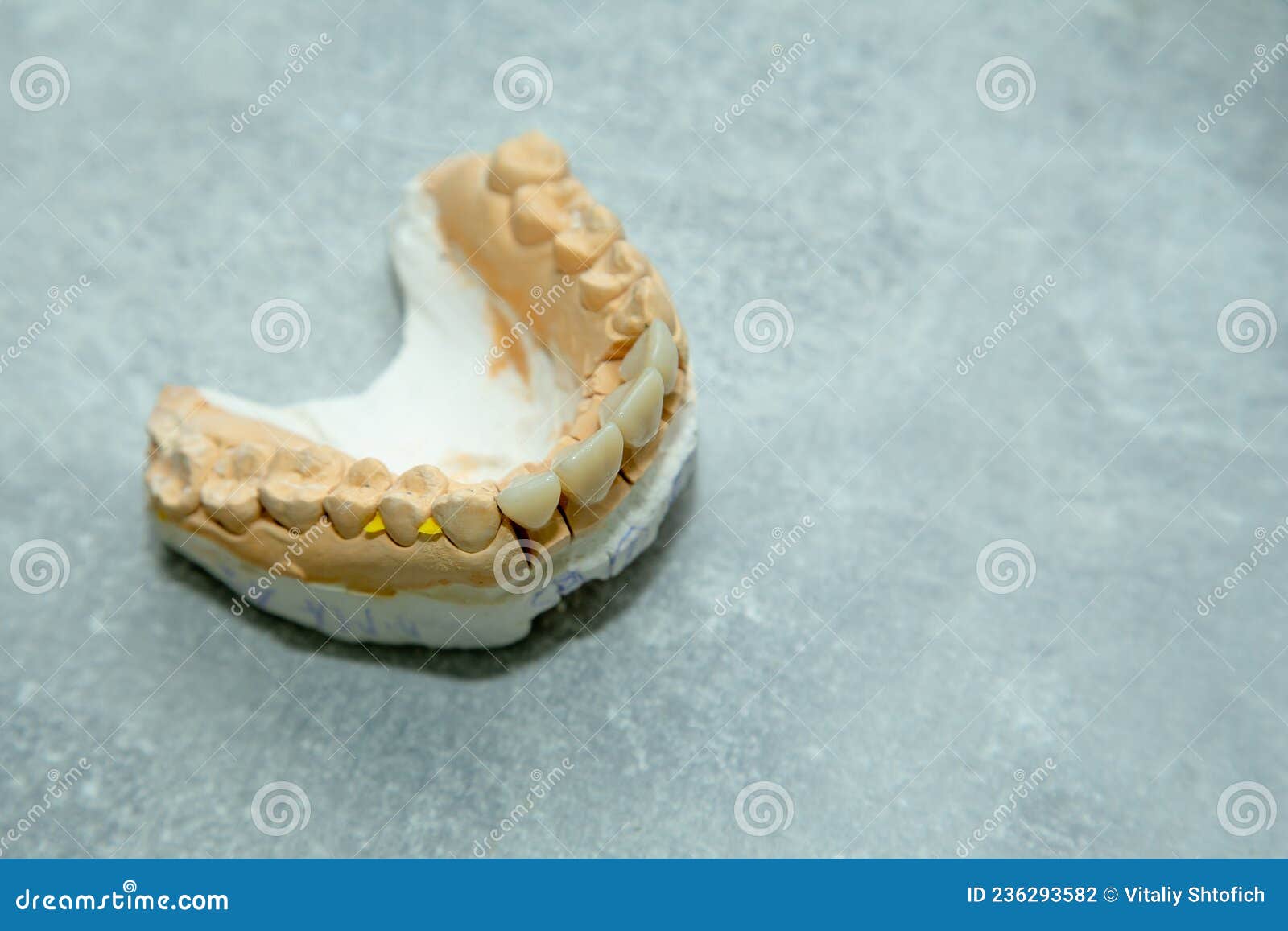 Layout of Teeth on the Table Stock Photo - Image of disease ...