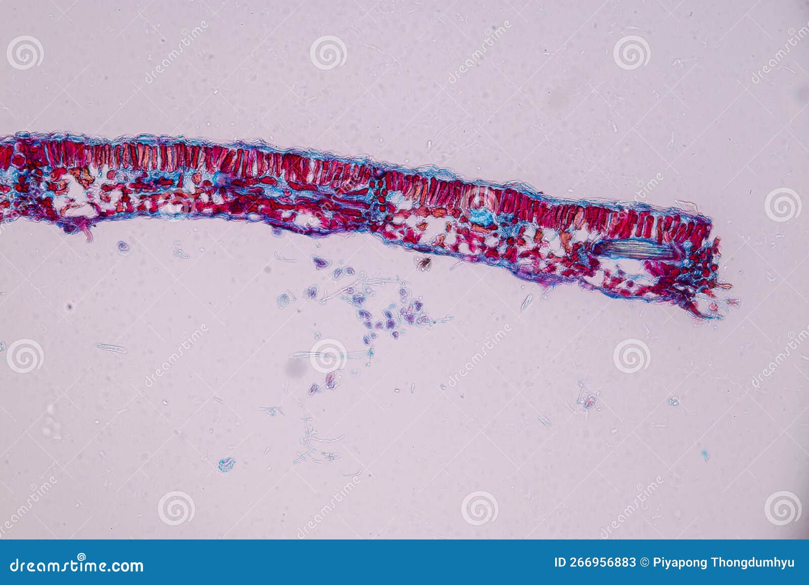 Le Cellule Ospiti Con Spore Muffe Sono All'interno Del Legno Sotto Il ... Le Cellule Ospiti Con Spore Muffe Sono All'interno Del Legno Sotto Il ...