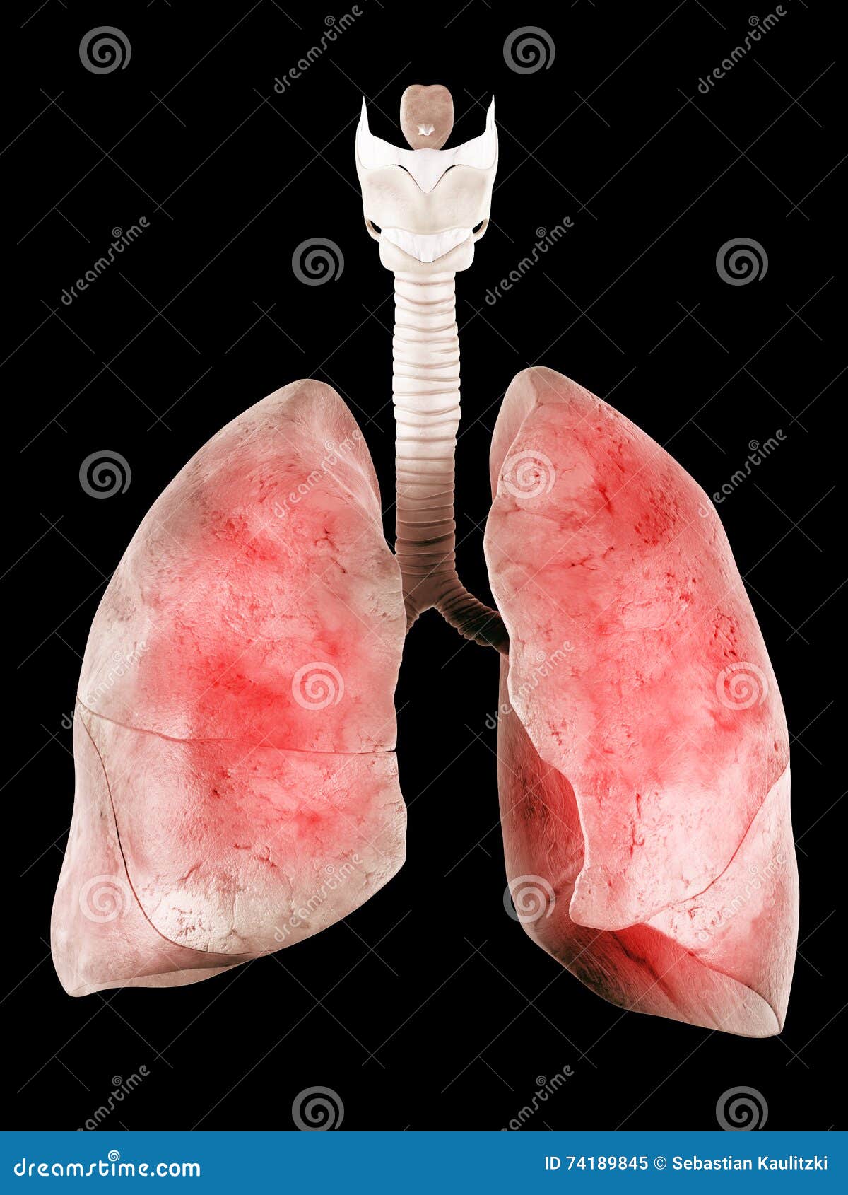 Le poumon humain illustration stock. Illustration du anatomie - 74189845