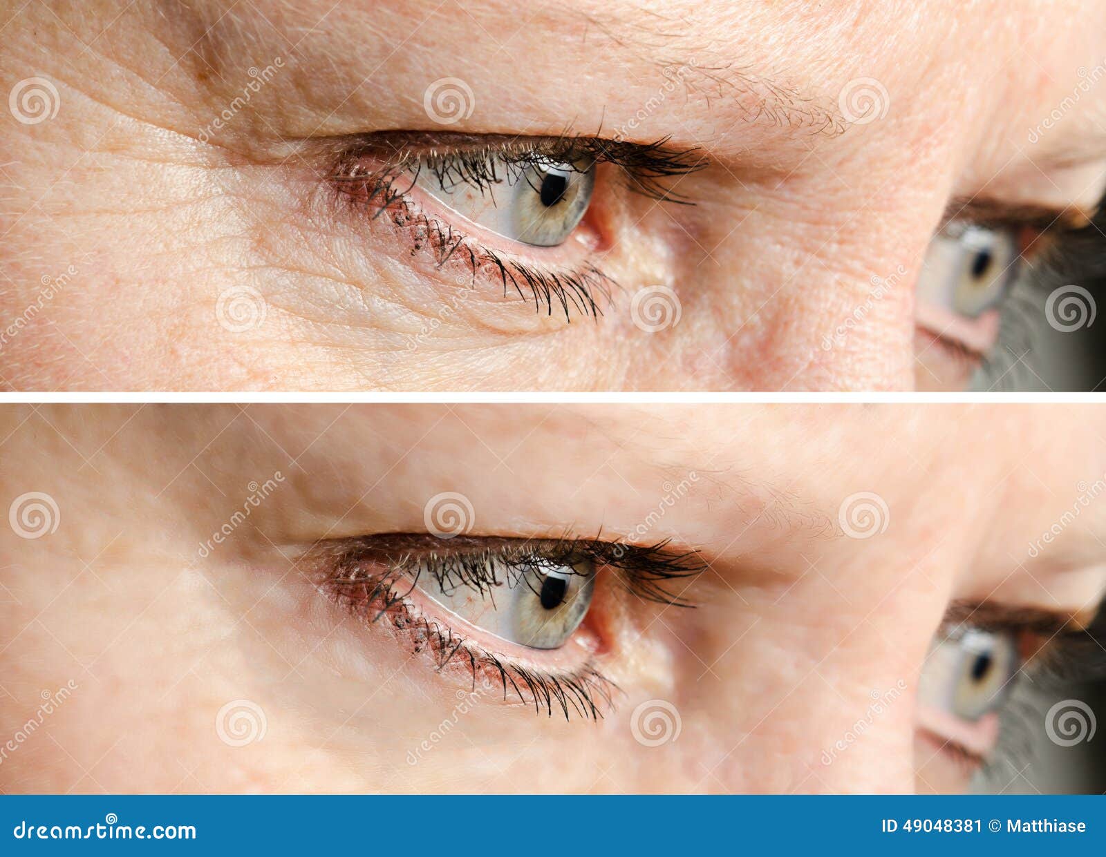 Le visage ride le retrait image stock. Image du anti - 49048381