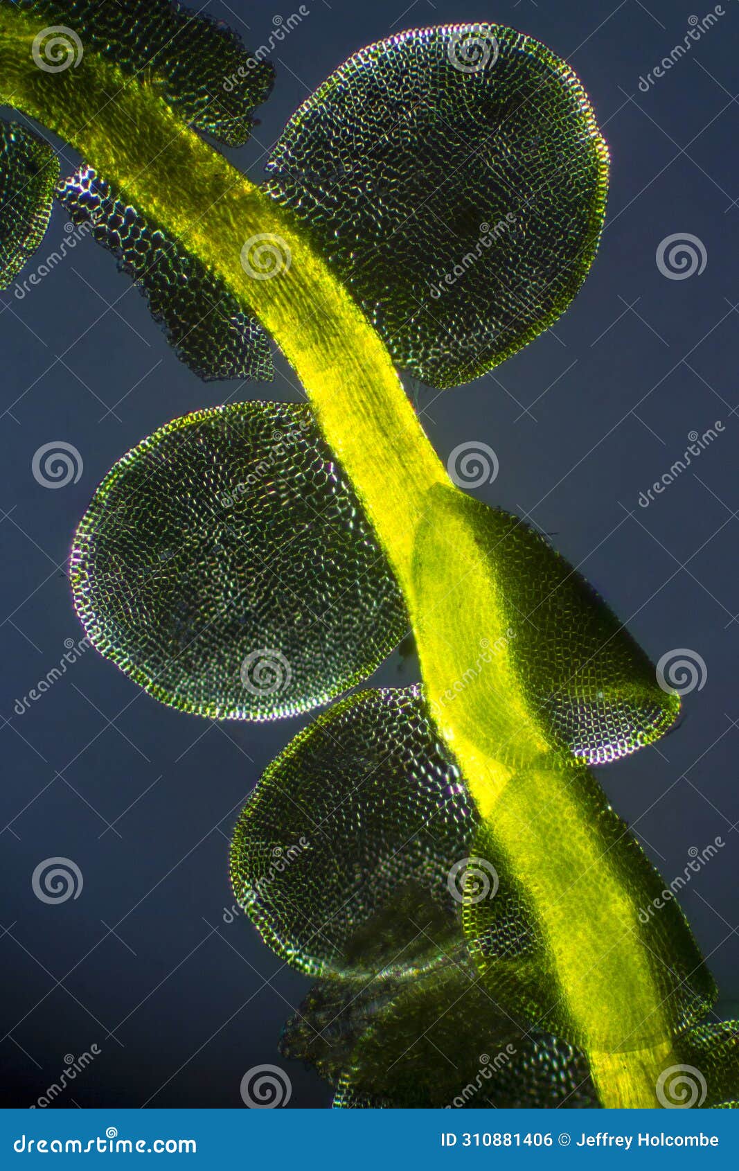 Leafy Liverwort with Glowing Leaf Margins in Polarization Microscopy ...