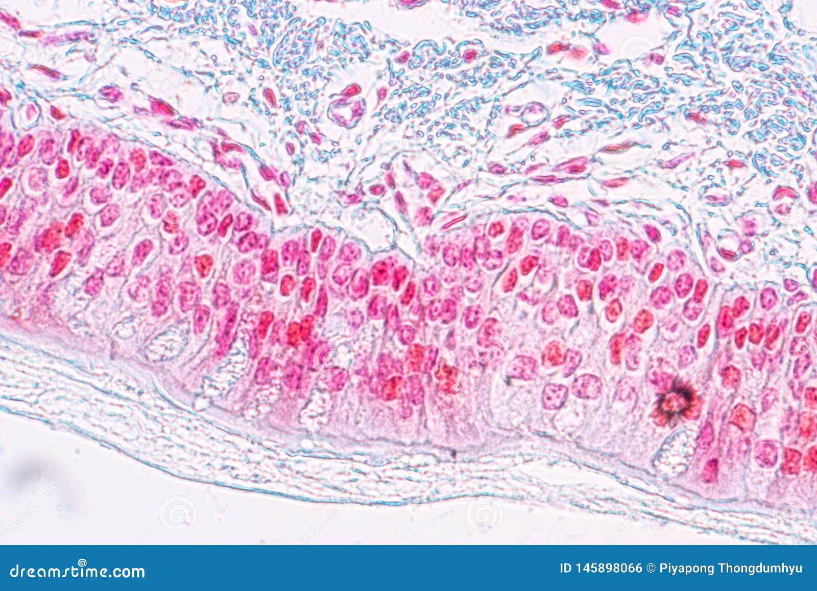 Learning Anatomy and Physiology of Pseudostratified Columnar Epithellum ...