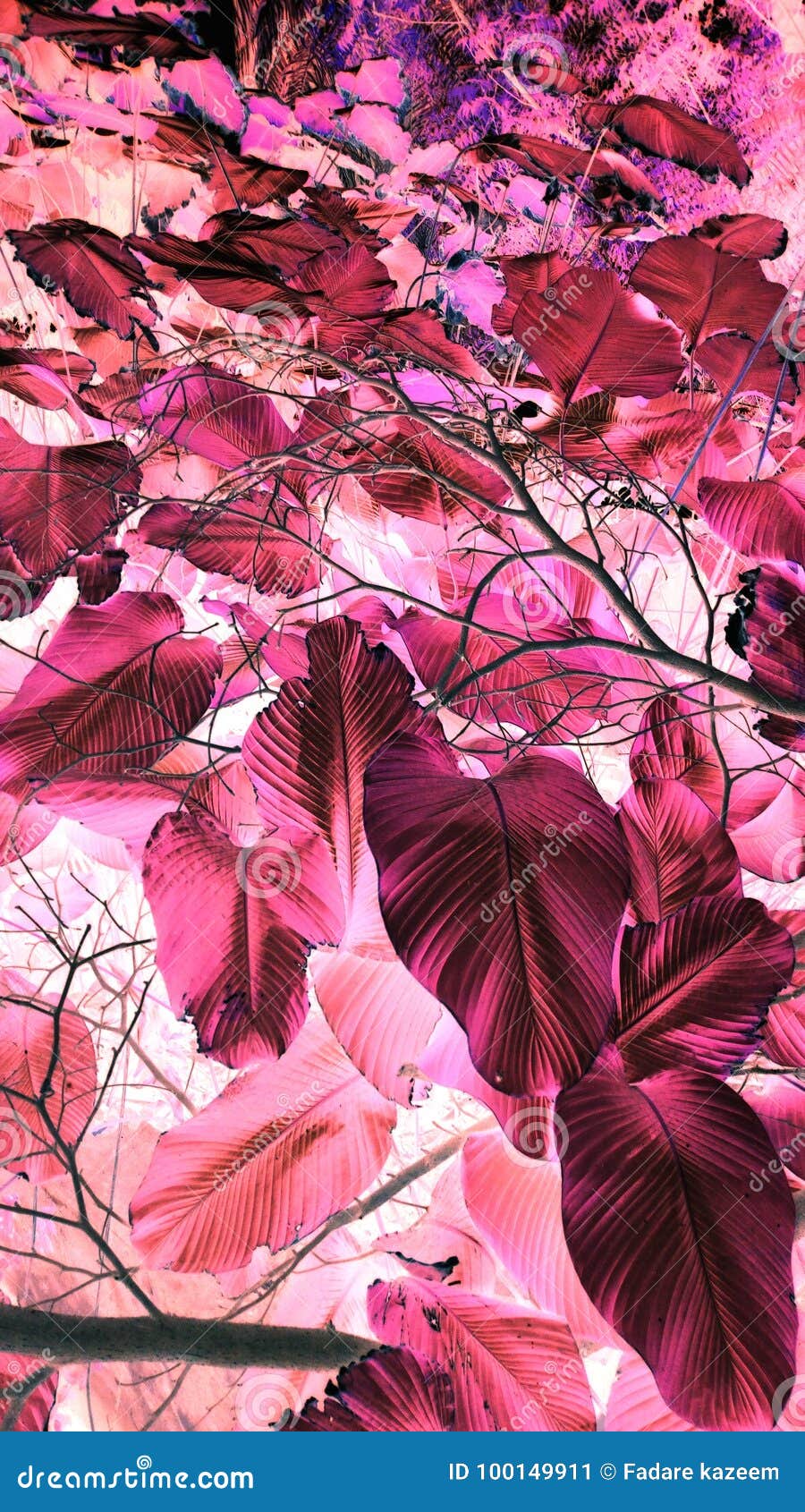 Negative X-ray Side View Of Acetabular Cavity Stock Image ...