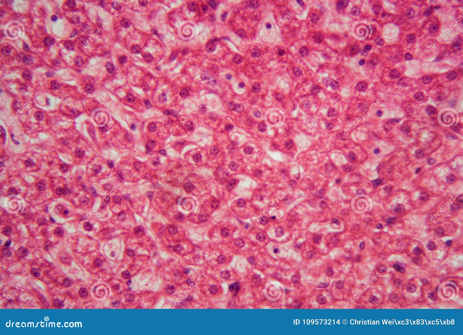 Leberzellen Unter Dem Mikroskop Stockfoto - Bild von gesundheit ...