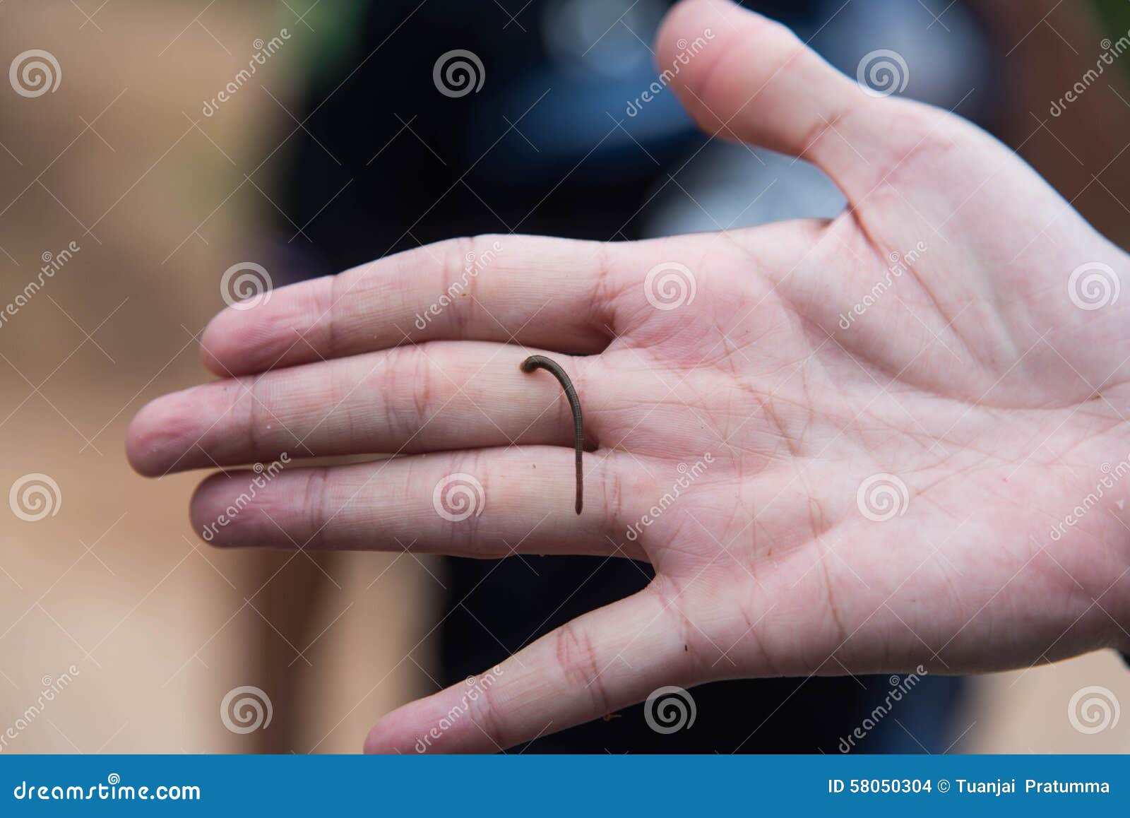 Leech On The Painful Inflamed Joint Royalty-Free Stock Photography ...