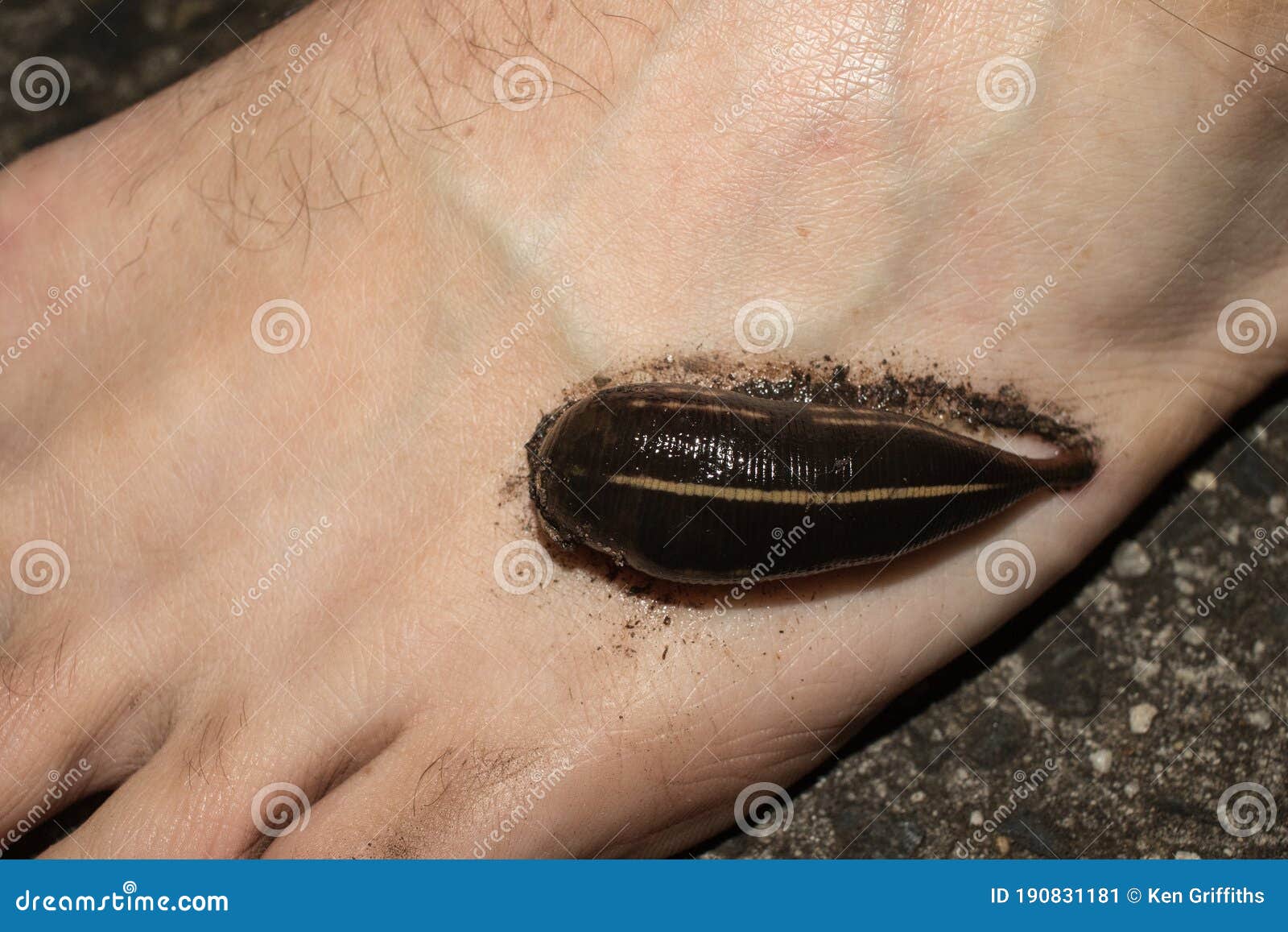 Leech on foot stock image. Image of natur, blood, sucking - 190831181