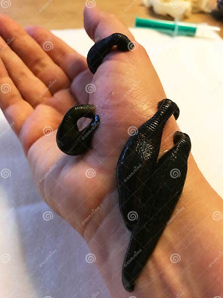 Leech Therapy on Hand for Osteoarthritis Stock Photo - Image of ...