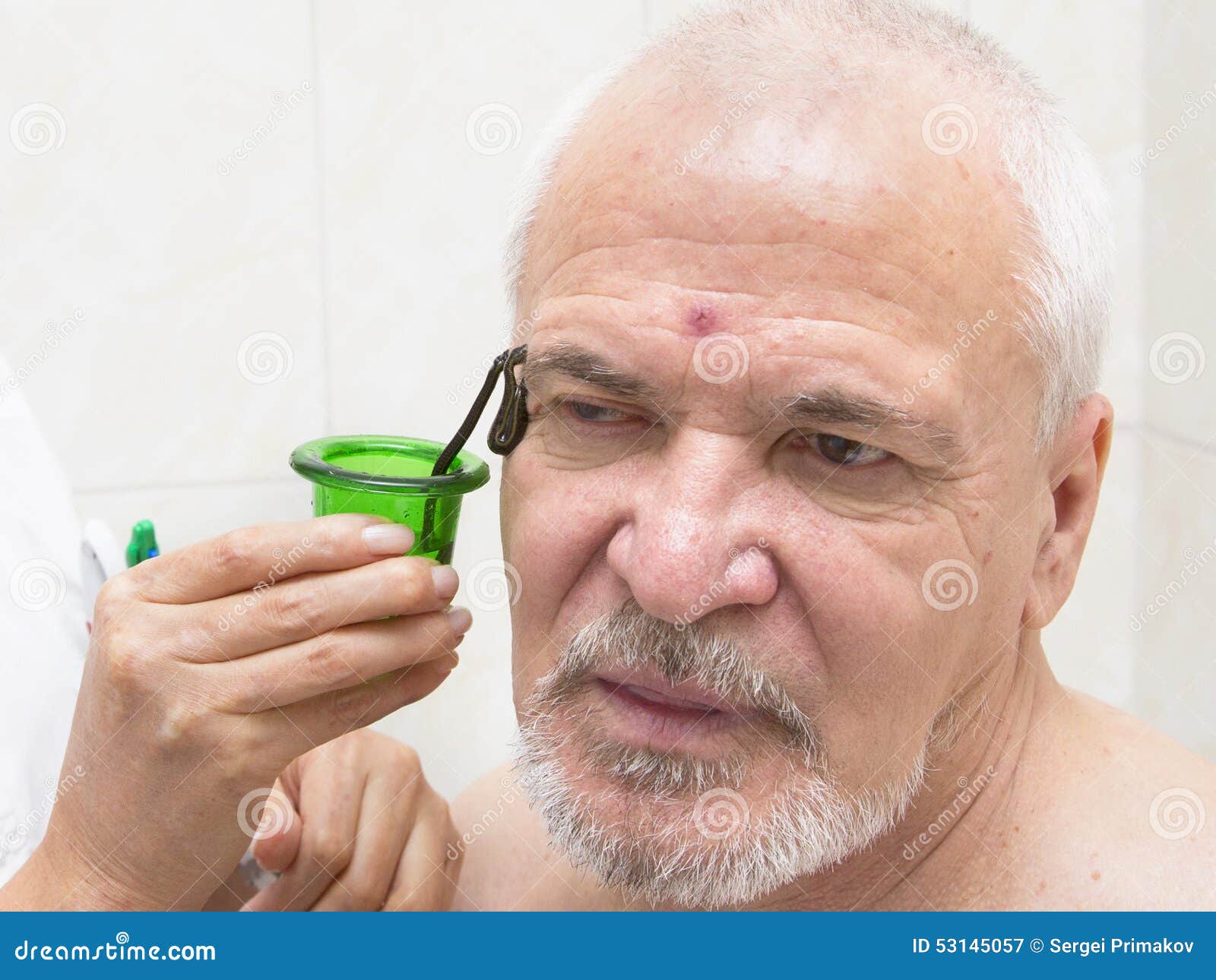 Leech therapy stock image. Image of treatment, color - 53145057