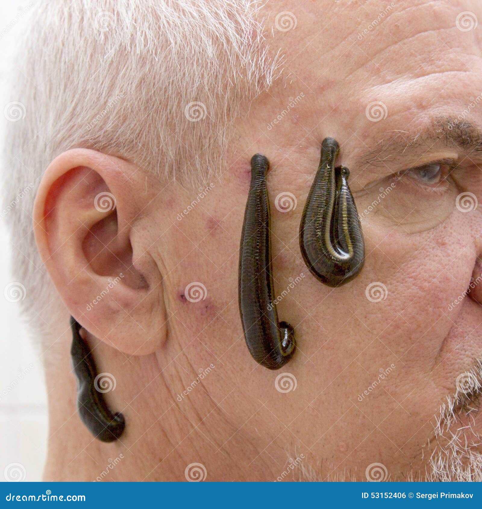 Leech therapy stock photo. Image of leech, pampering - 53152406