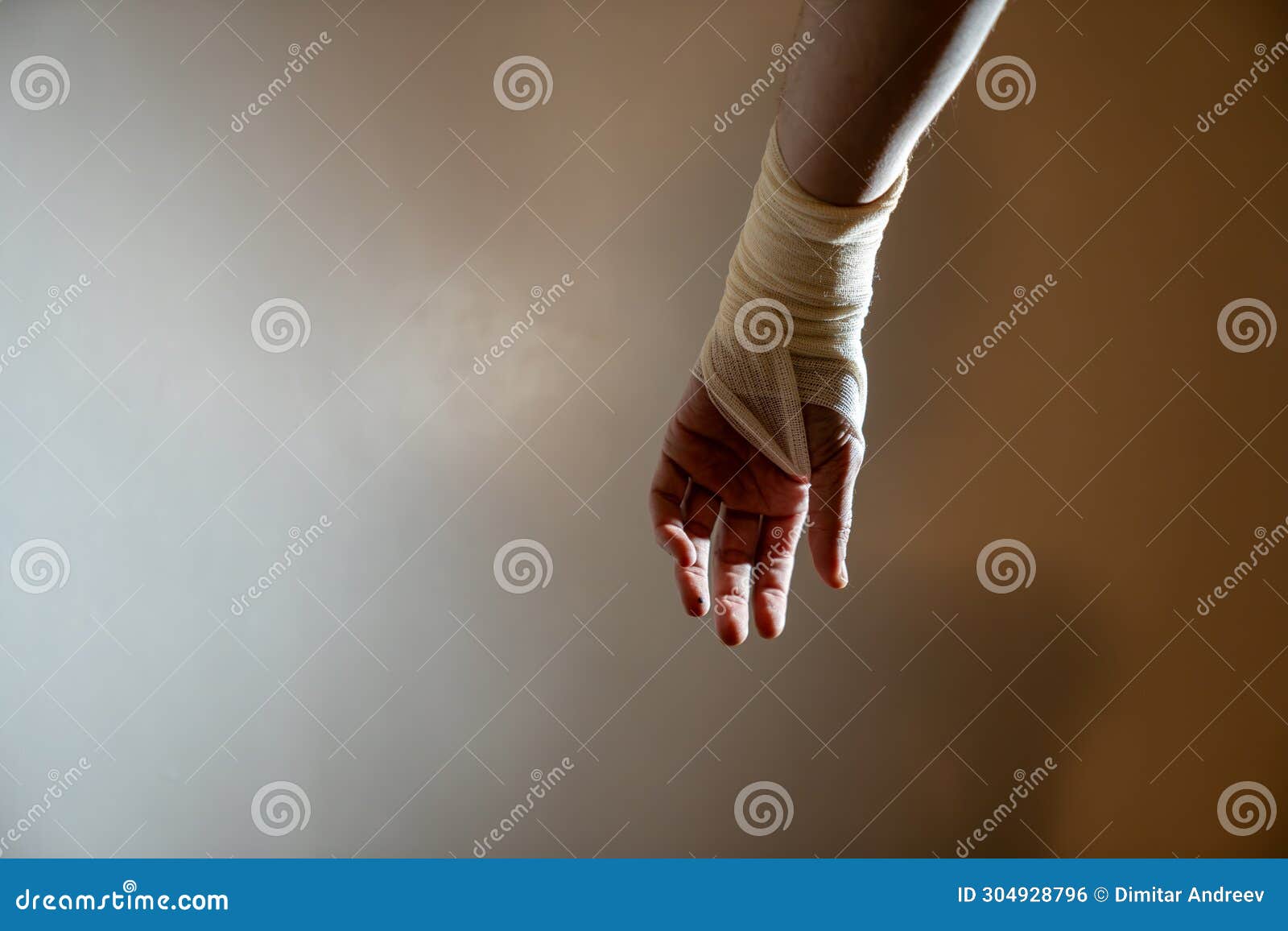 Left hand injury stock photo. Image of doctor, bandaging - 304928796