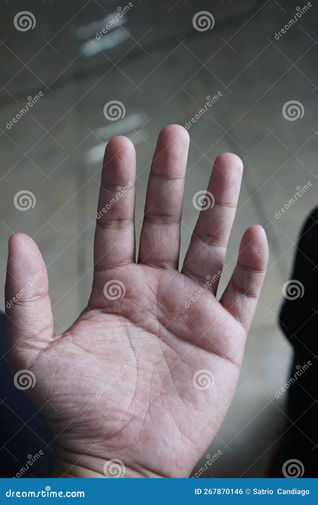 A Young Man S Left Hand, Which is Facing Up. Stock Photo - Image of ...