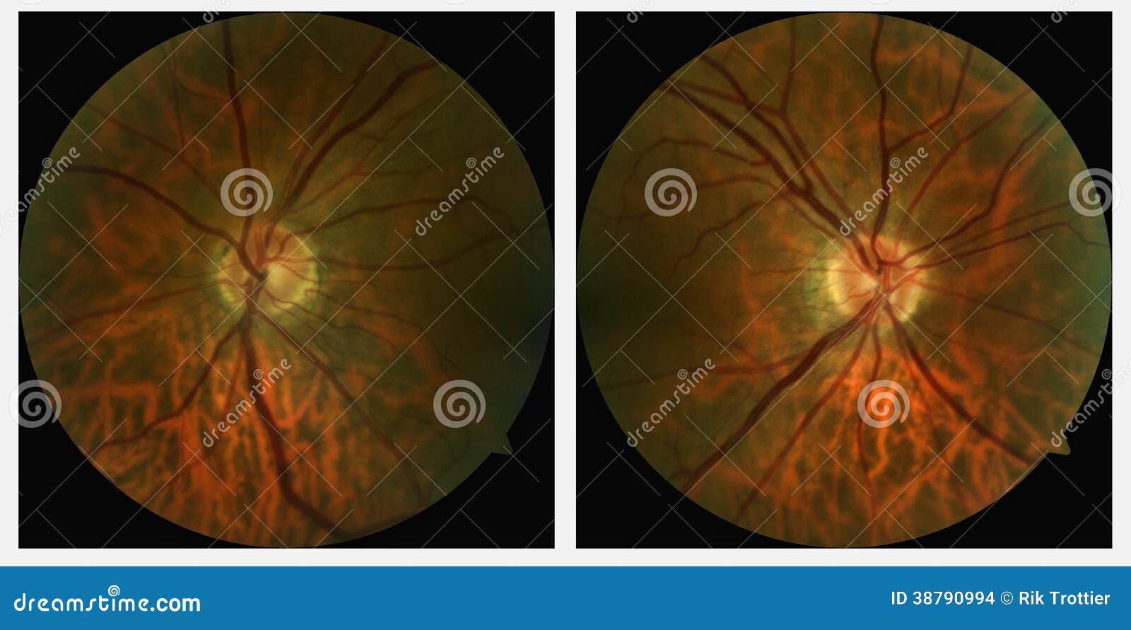 Left and right Eye scans stock illustration. Illustration of retina ...