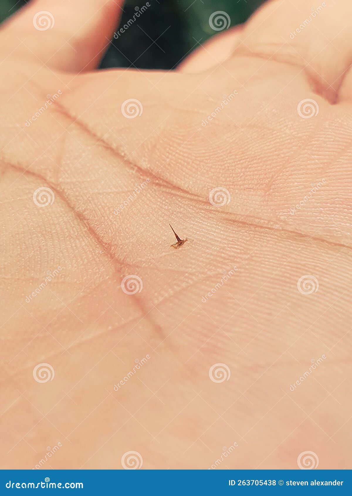 Leftover bee sting on hand stock photo. Image of stings - 263705438