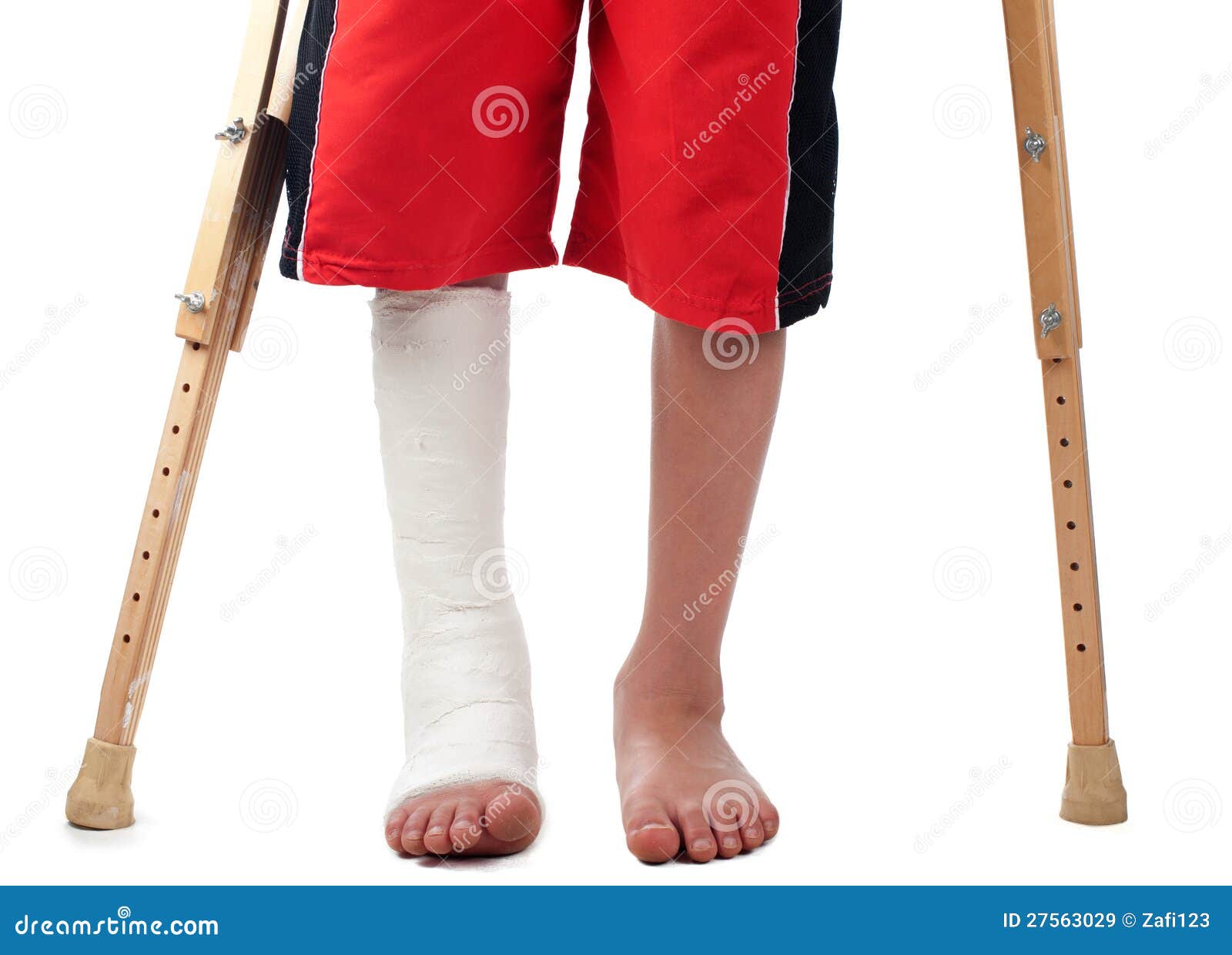 Fractured Leg Quotes