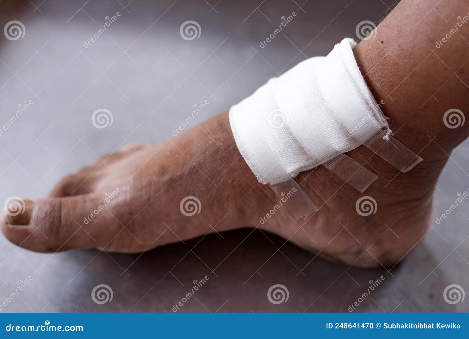 Leg injury stock photo. Image of joint, paramedic, doctor - 248641470