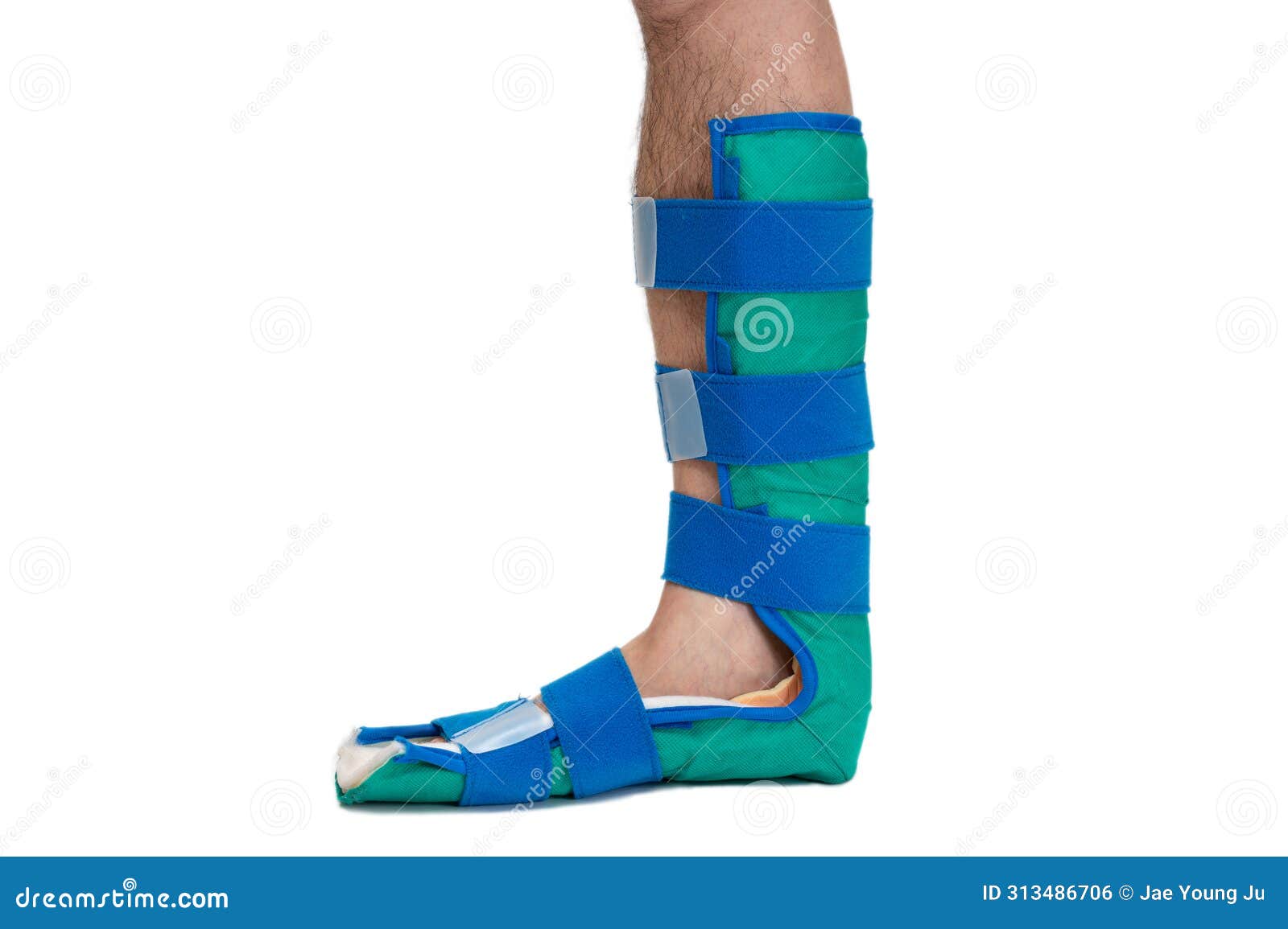 Leg of a Man in a Plaster Cast on a White Background Stock Photo ...