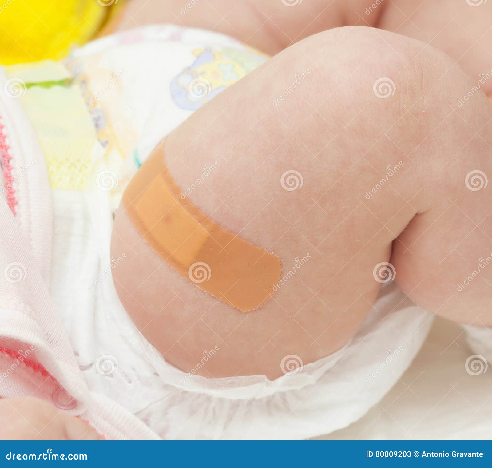 Leg of a Newborn with the Patch after Vaccination. Stock Image - Image ...