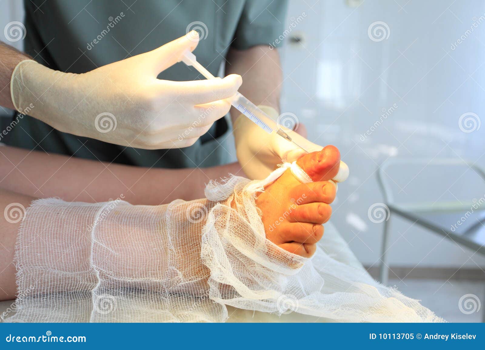 Leg operation stock image. Image of hazardous, face, practice - 10113705