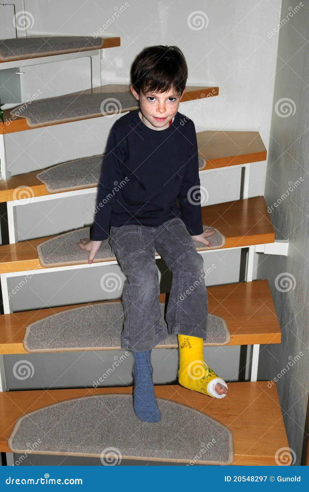 Leg in plaster stock image. Image of legs, bandage, broken - 20548297