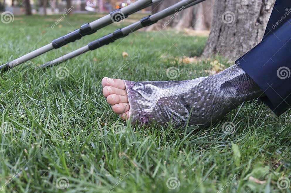 Leg in Plaster of a Boy and Crutches Stock Photo - Image of sprain ...