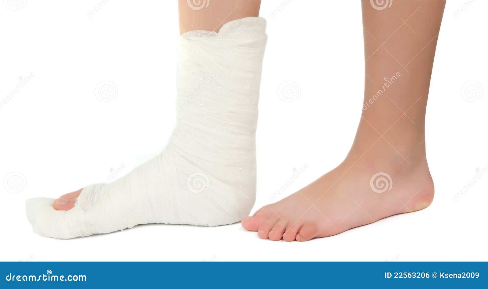 Leg in a plaster cast stock photo. Image of equipment - 22563206