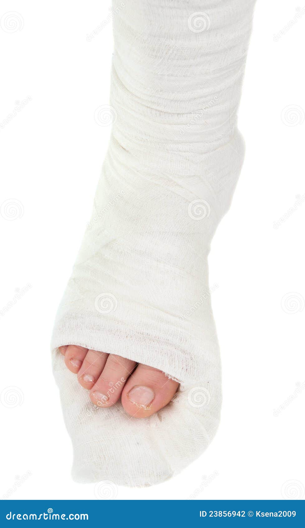 Leg in a plaster cast stock photo. Image of physical - 23856942