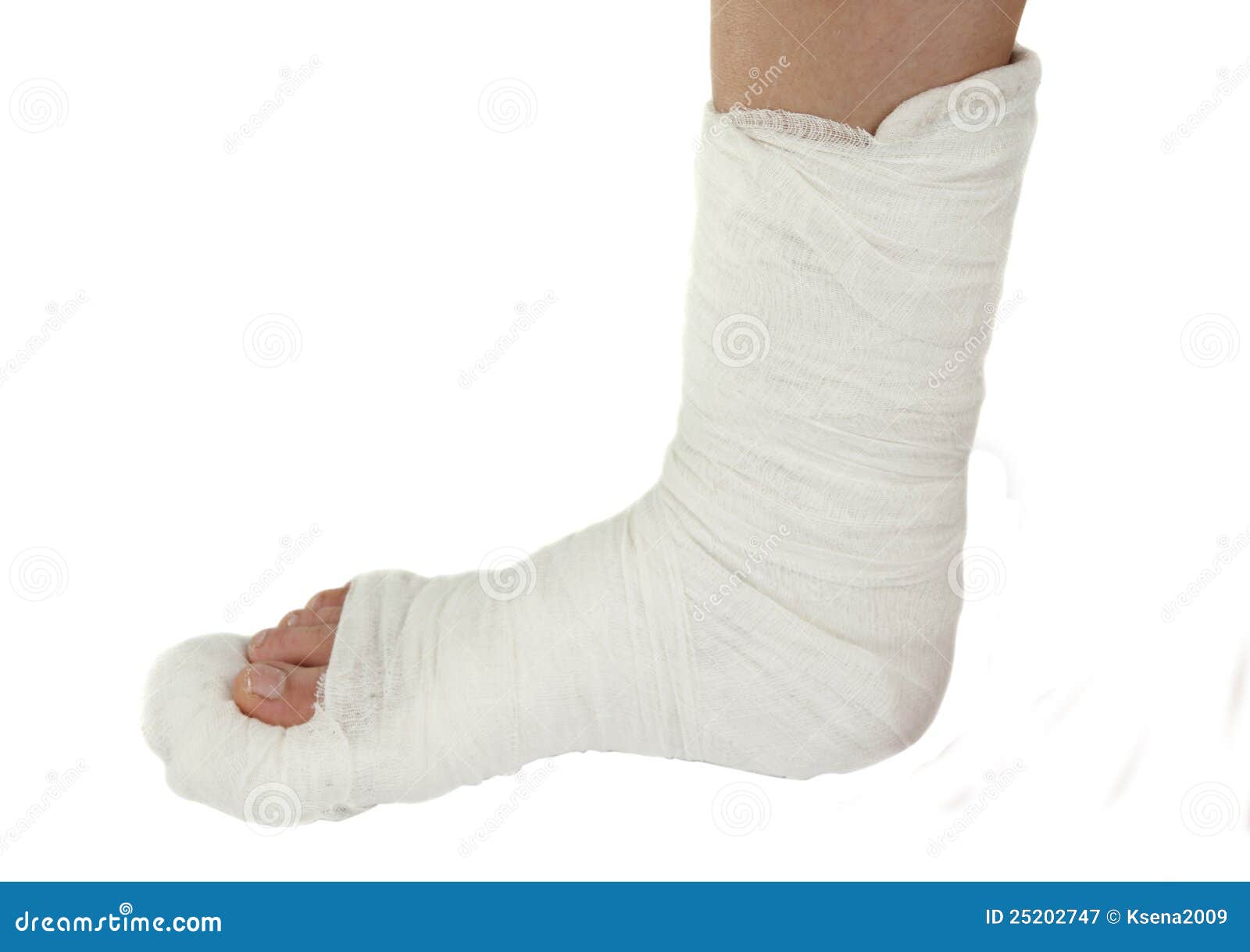 Leg In A Plaster Cast Royalty Free Stock Photography - Image: 25202747
