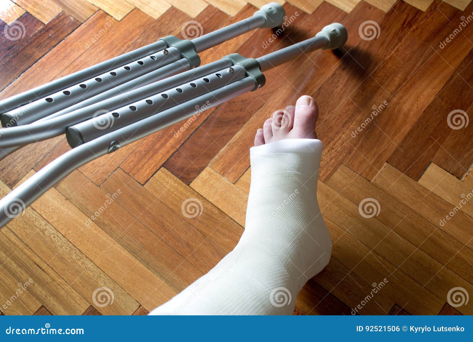 Leg in plaster stock photo. Image of barefoot, illness - 92521506