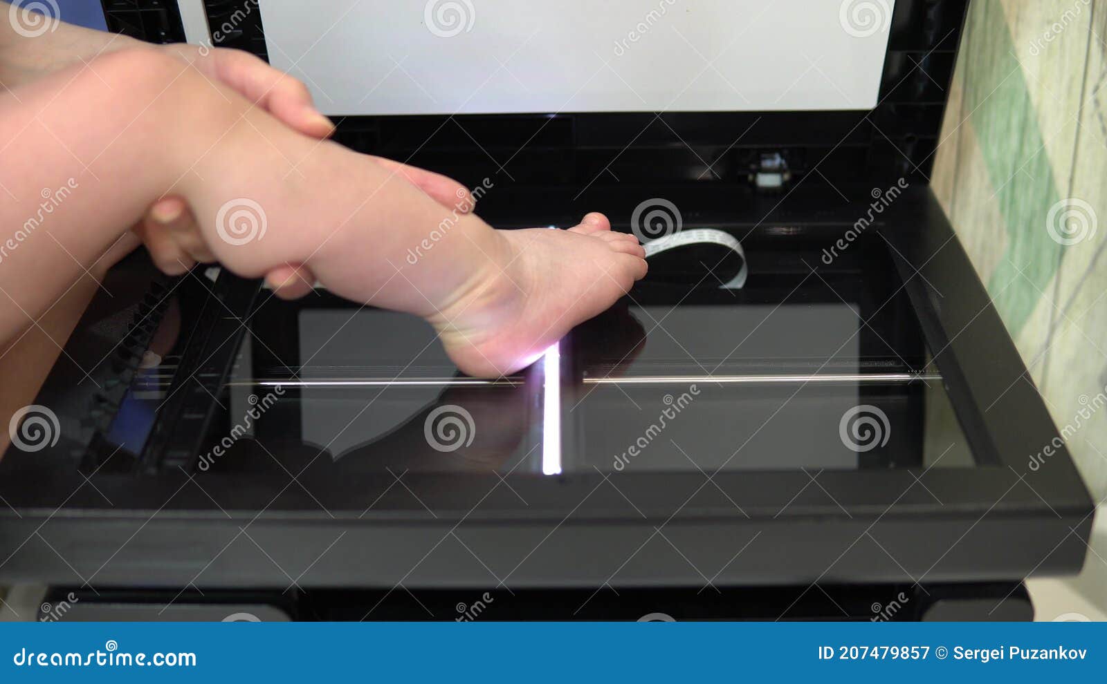 Leg Scan Process. the Scanner in Operation Scans a Child& X27;s Foot ...