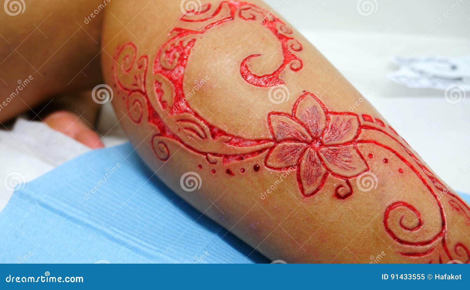 Leg with scarification stock image. Image of aesthetic - 91433555