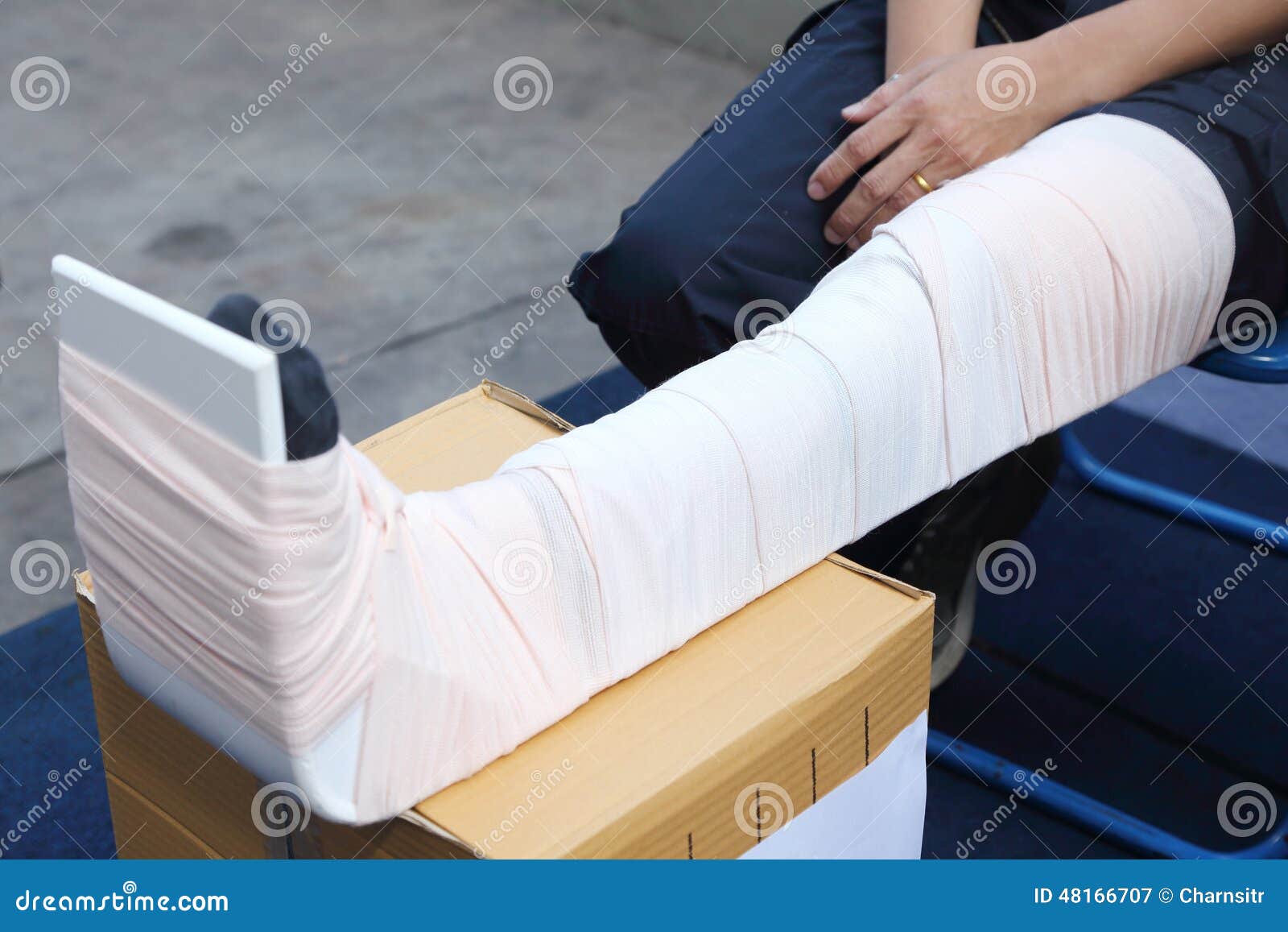 Leg with a splint stock image. Image of bone, bandage - 48166707