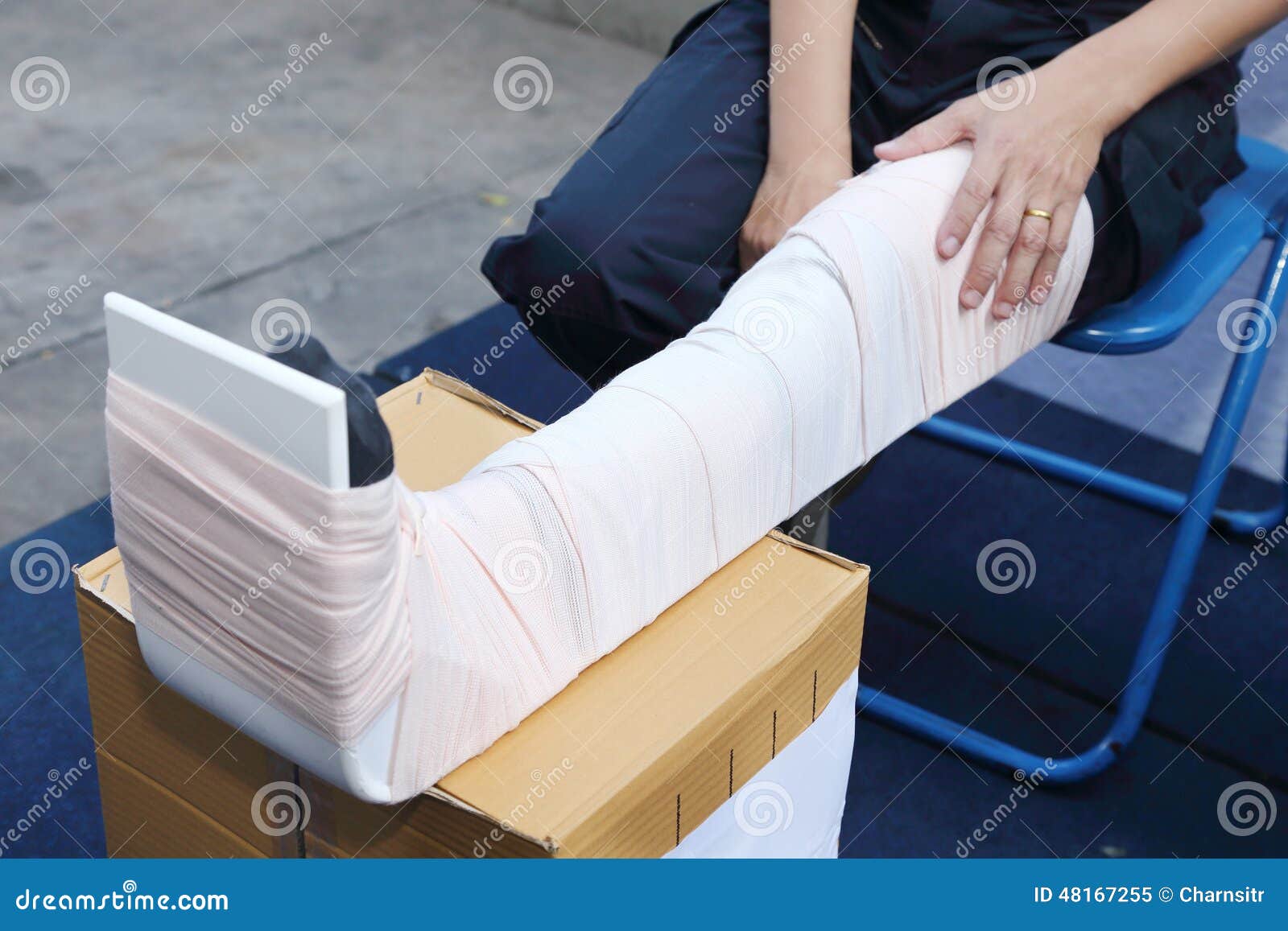 Leg with a splint stock image. Image of care, healthy - 48167255