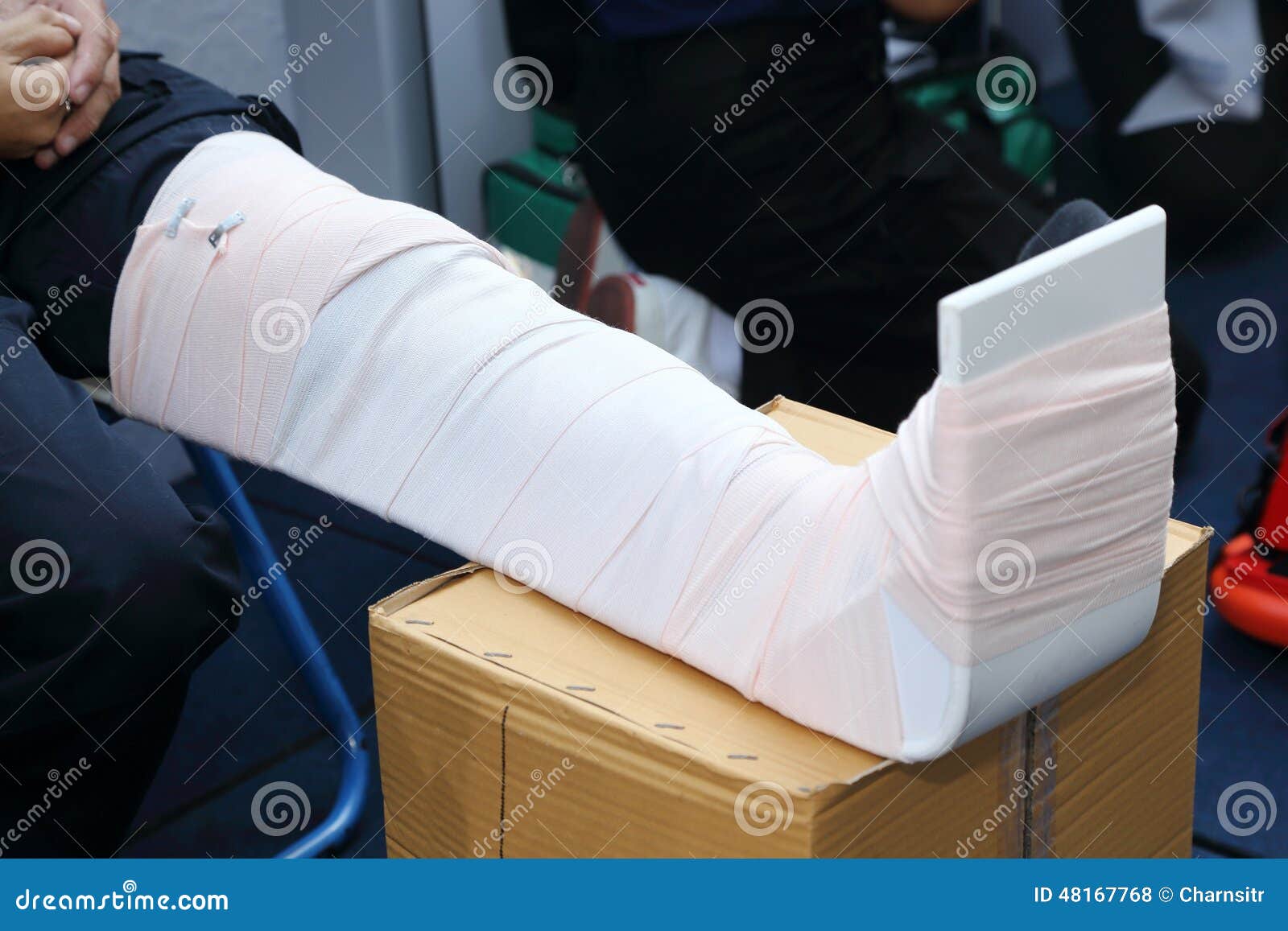 Leg with a splint stock photo. Image of anatomy, barefoot - 48167768