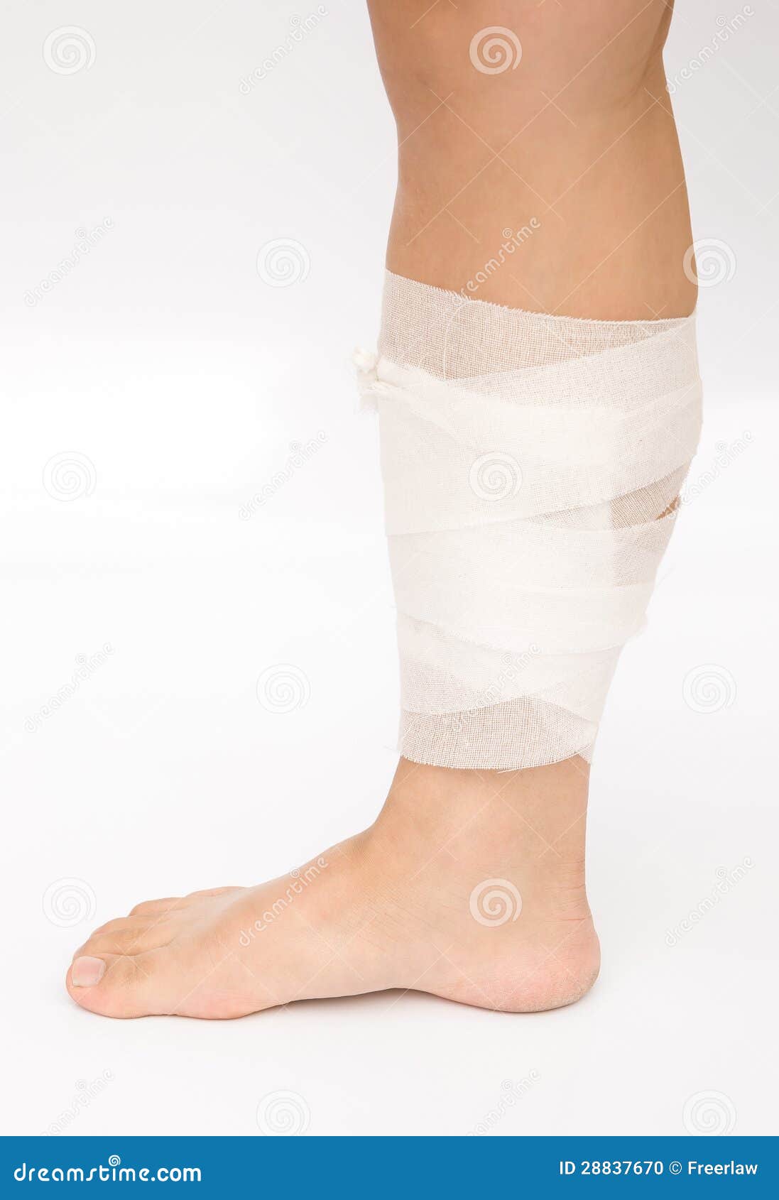 Leg wrapped with bandage stock photo. Image of injury - 28837670