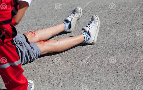 Legs injuries stock image. Image of blood, patient, scar - 22179963