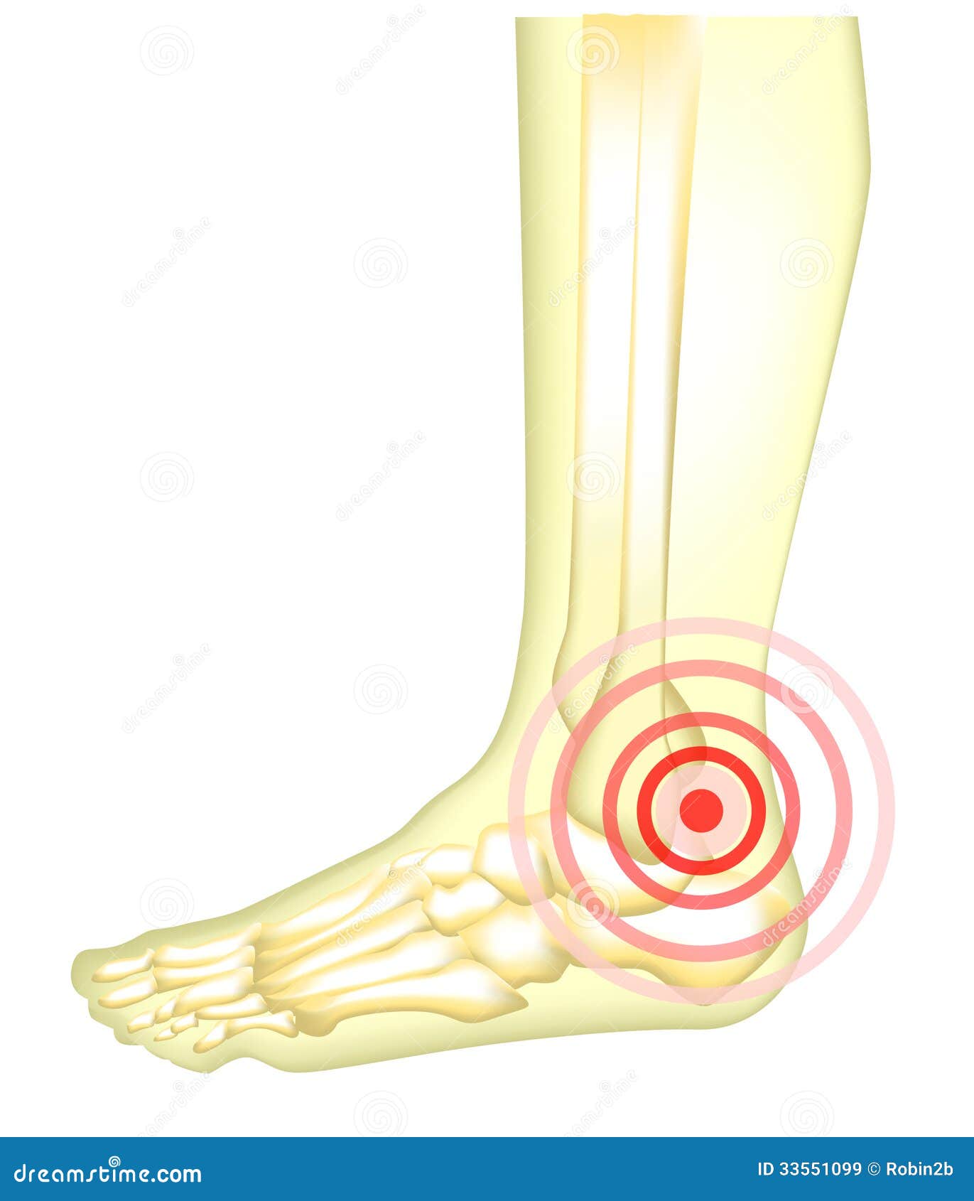 Legs pain stock vector. Illustration of girl, hurt, foot - 33551099