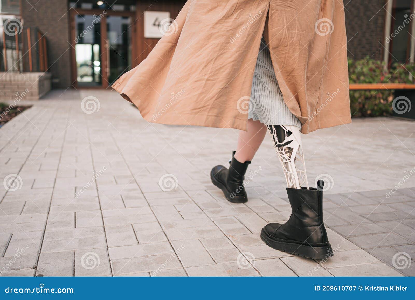 Legs of a Young Girl with a Bionic Prosthesis, Back View Stock Image ...