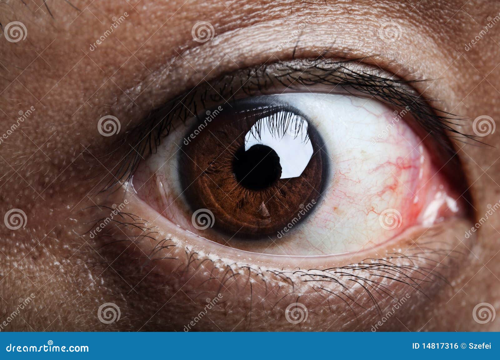 Lelijk oog stock foto. Image of wimpers, hoofd, vrees - 14817316