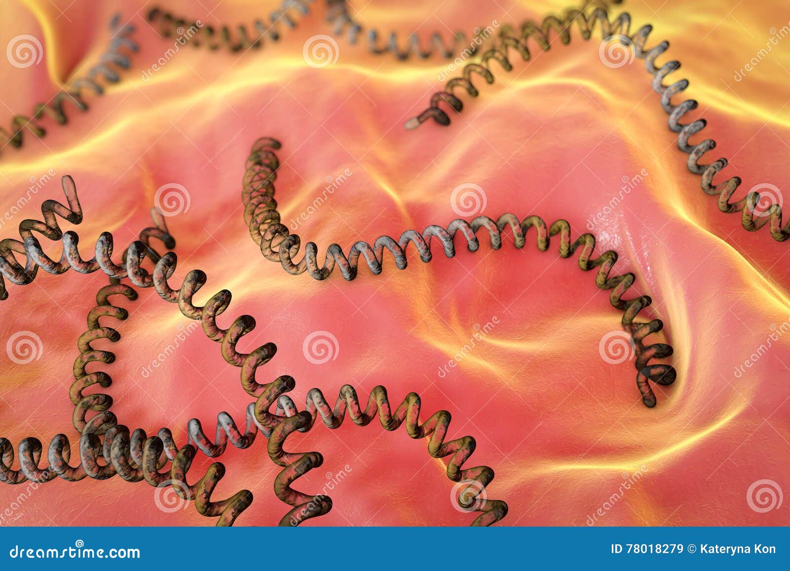 Leptospira, Bacterias Que Causan Leptospirosis Stock de ilustración ...