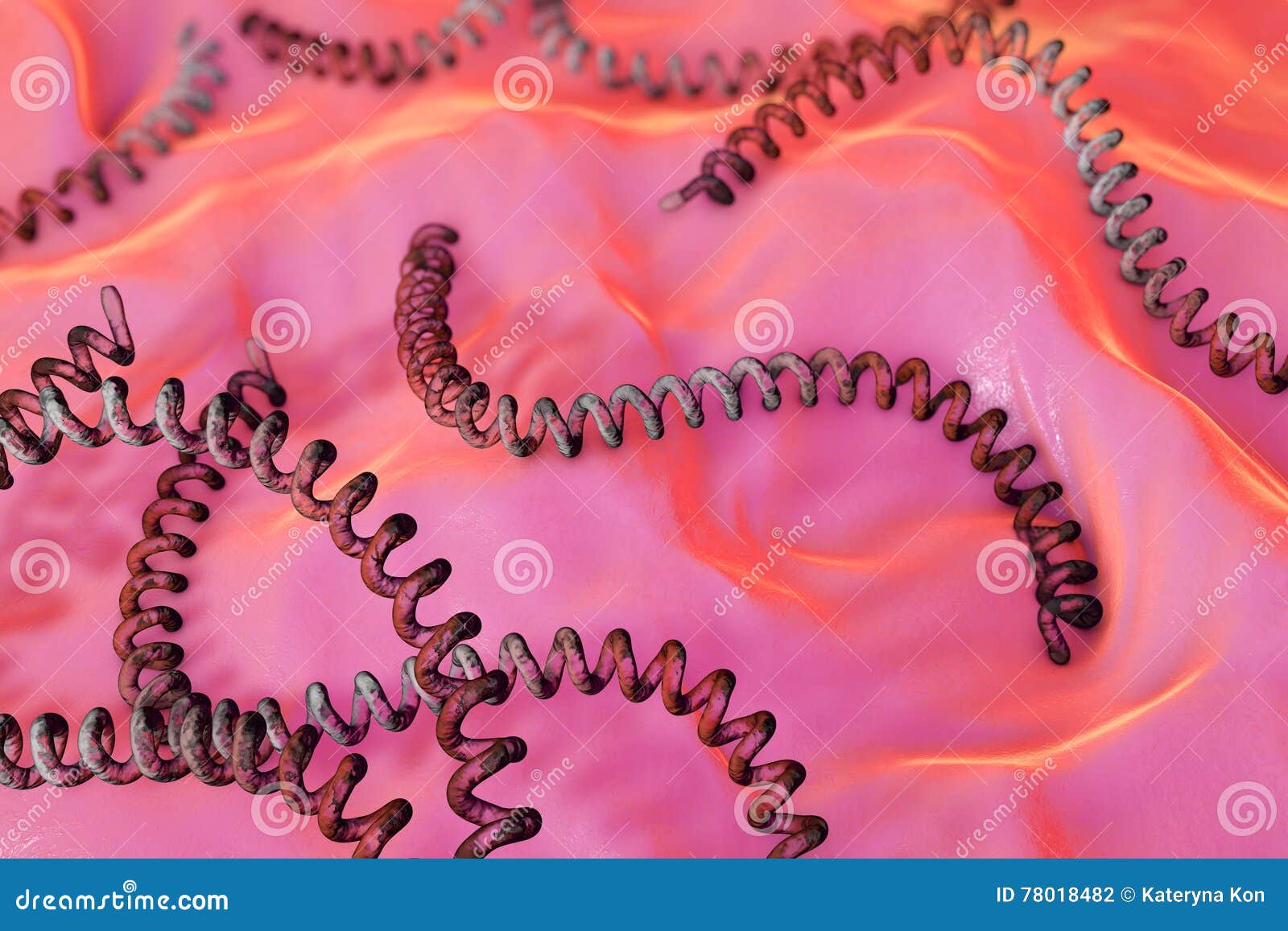 Leptospira, Bacterias Que Causan Leptospirosis Stock de ilustración ...