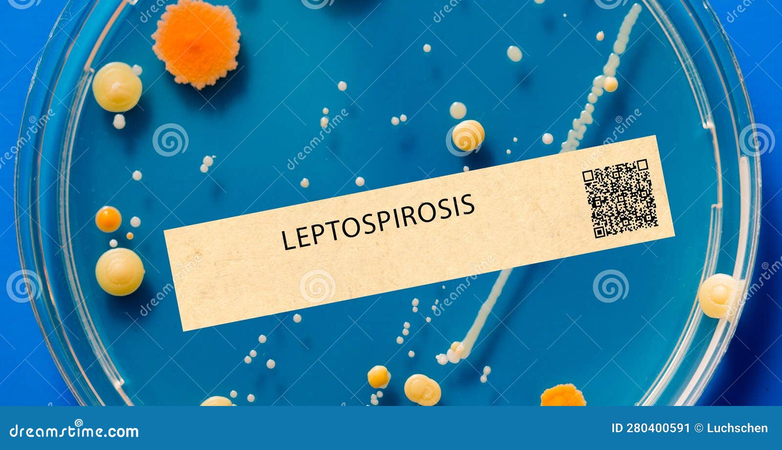 Leptospirosis - Bacterial Infection Transmitted through Contact Stock ...