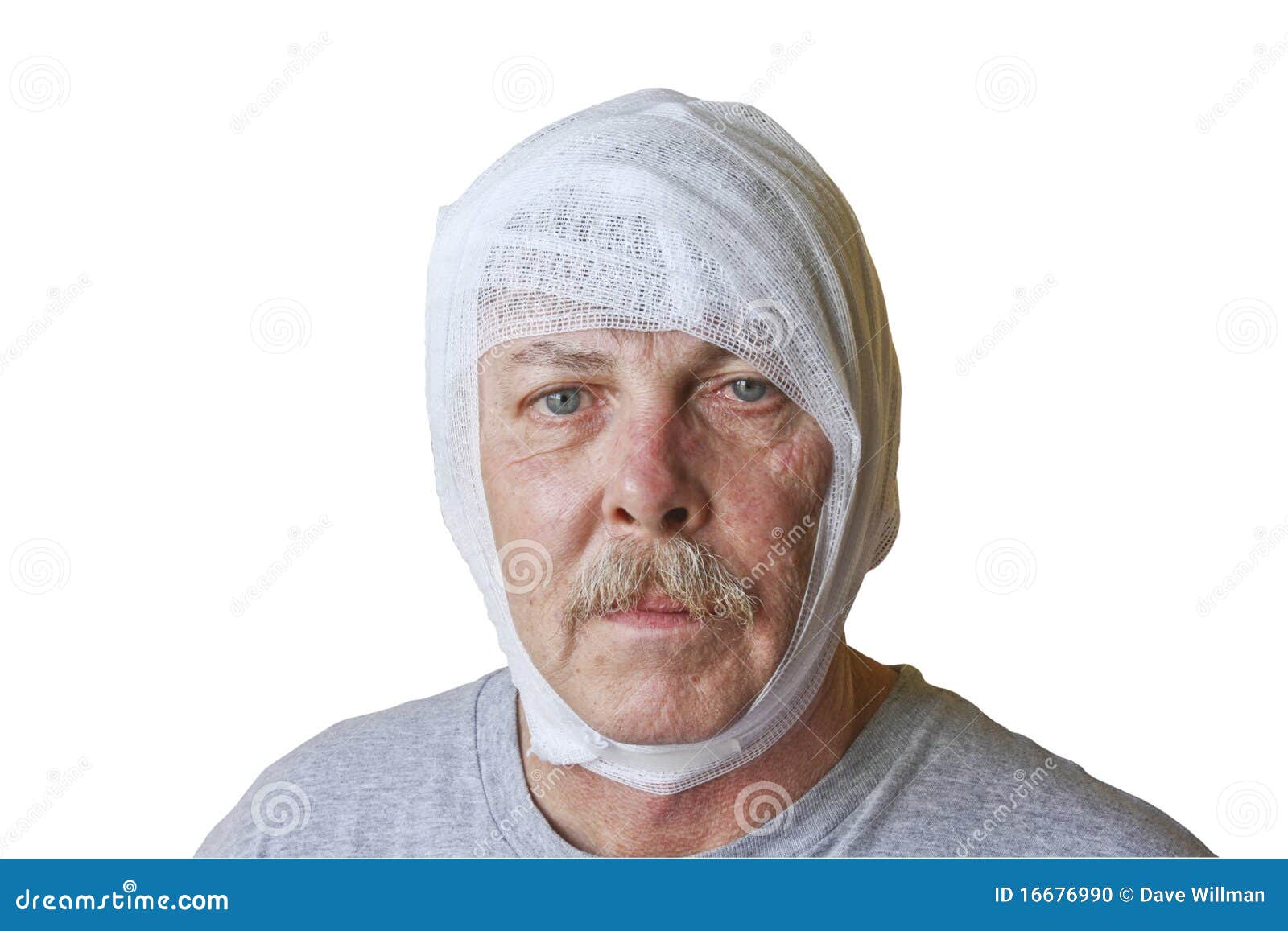 Lesión en la cabeza foto de archivo. Imagen de truncamiento - 16676990